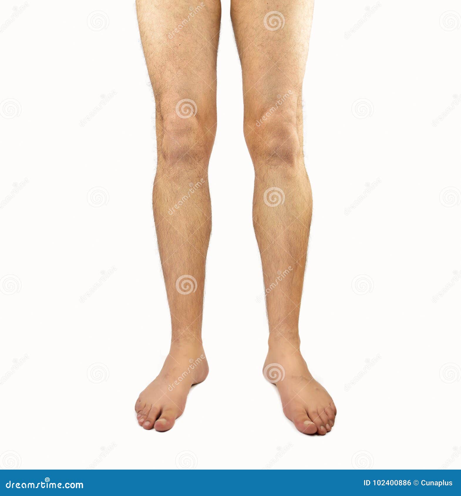 Gambe pelose dell'uomo fotografia stock. Immagine di asciutto - 102400886