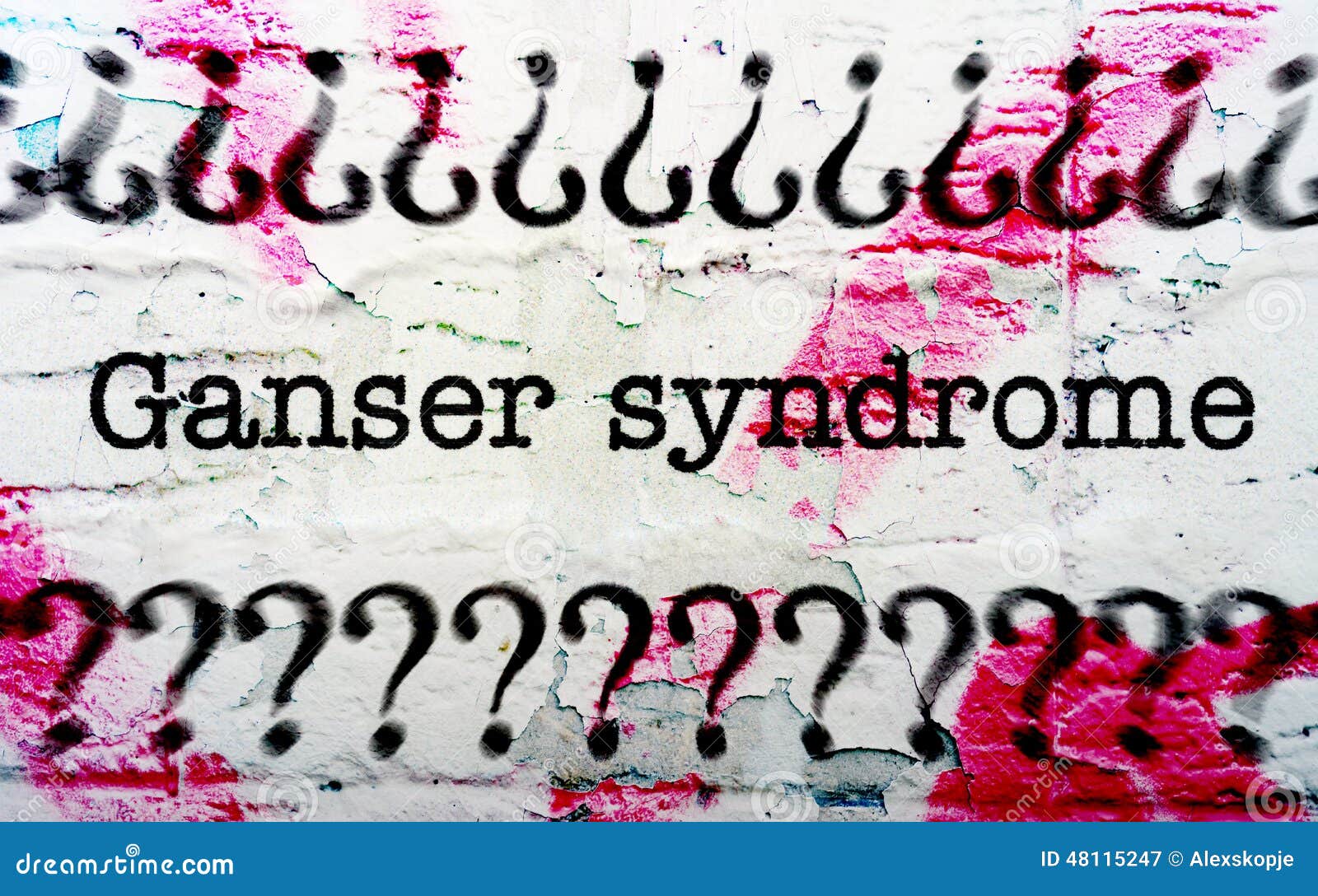 Ganser syndrome stock image. Image of histrionic, think - 48115247