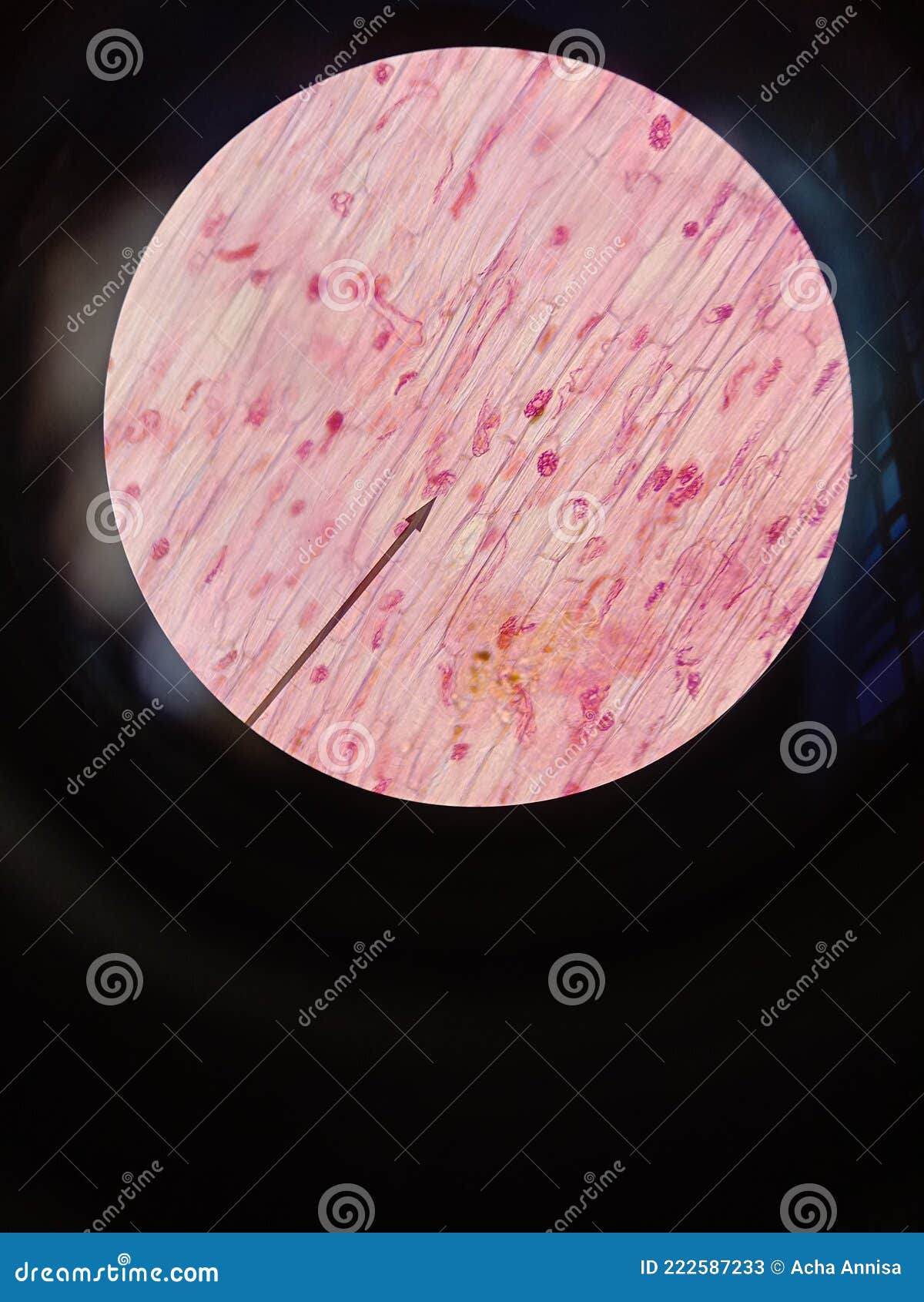 Garlic Root Cells Under a Microscope Stock Image - Image of cells ...