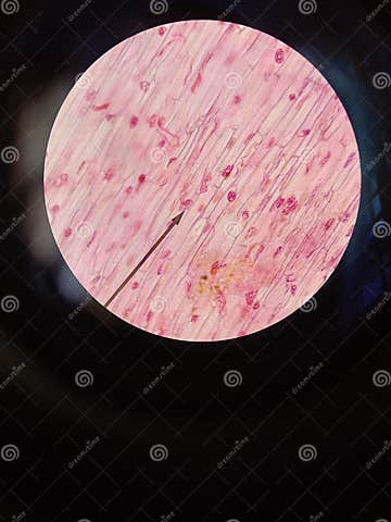 Garlic Root Cells Under a Microscope Stock Image - Image of cells ...