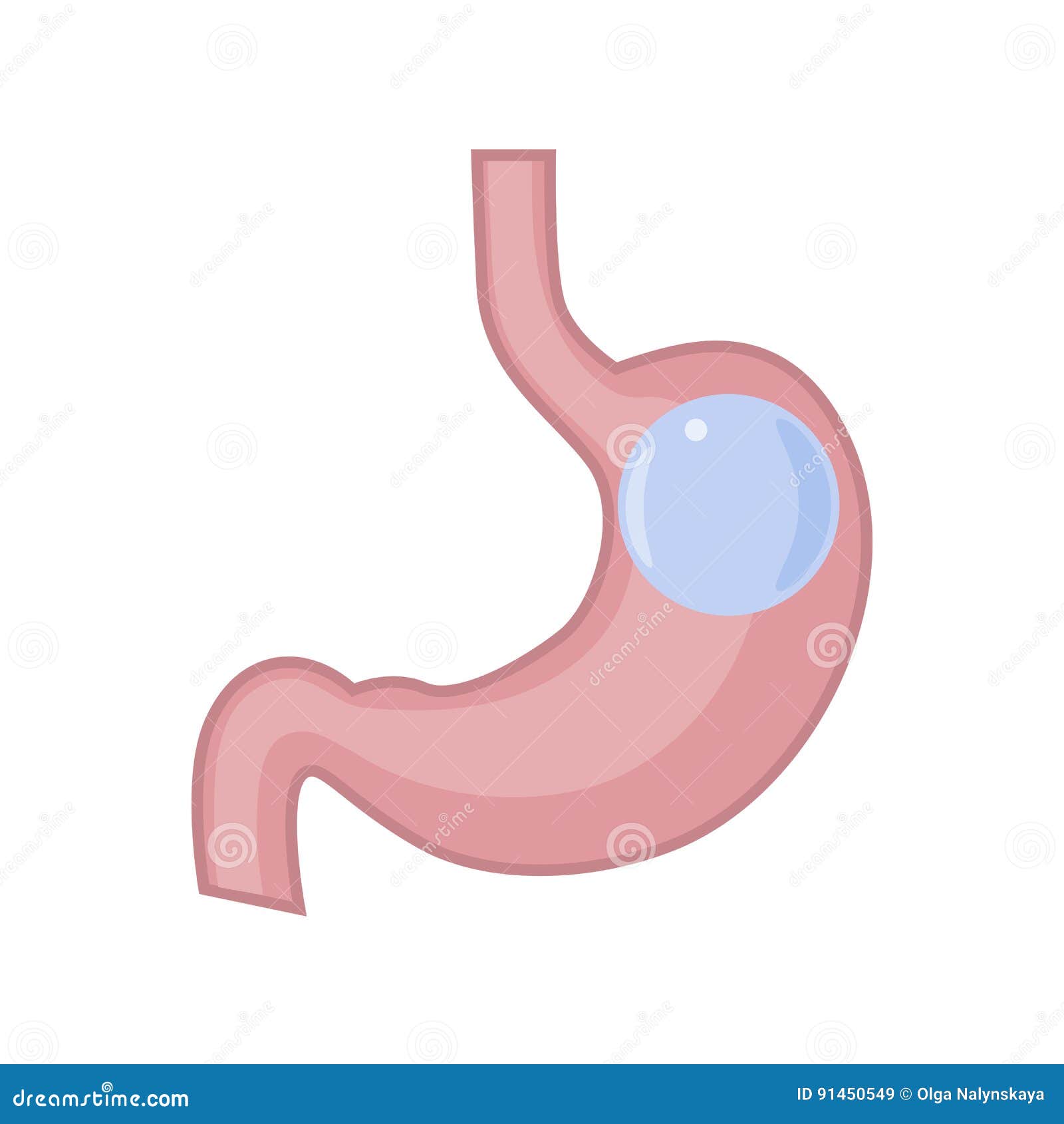 Gastric Balloon Stomach stock vector. Illustration of lapband - 91450549
