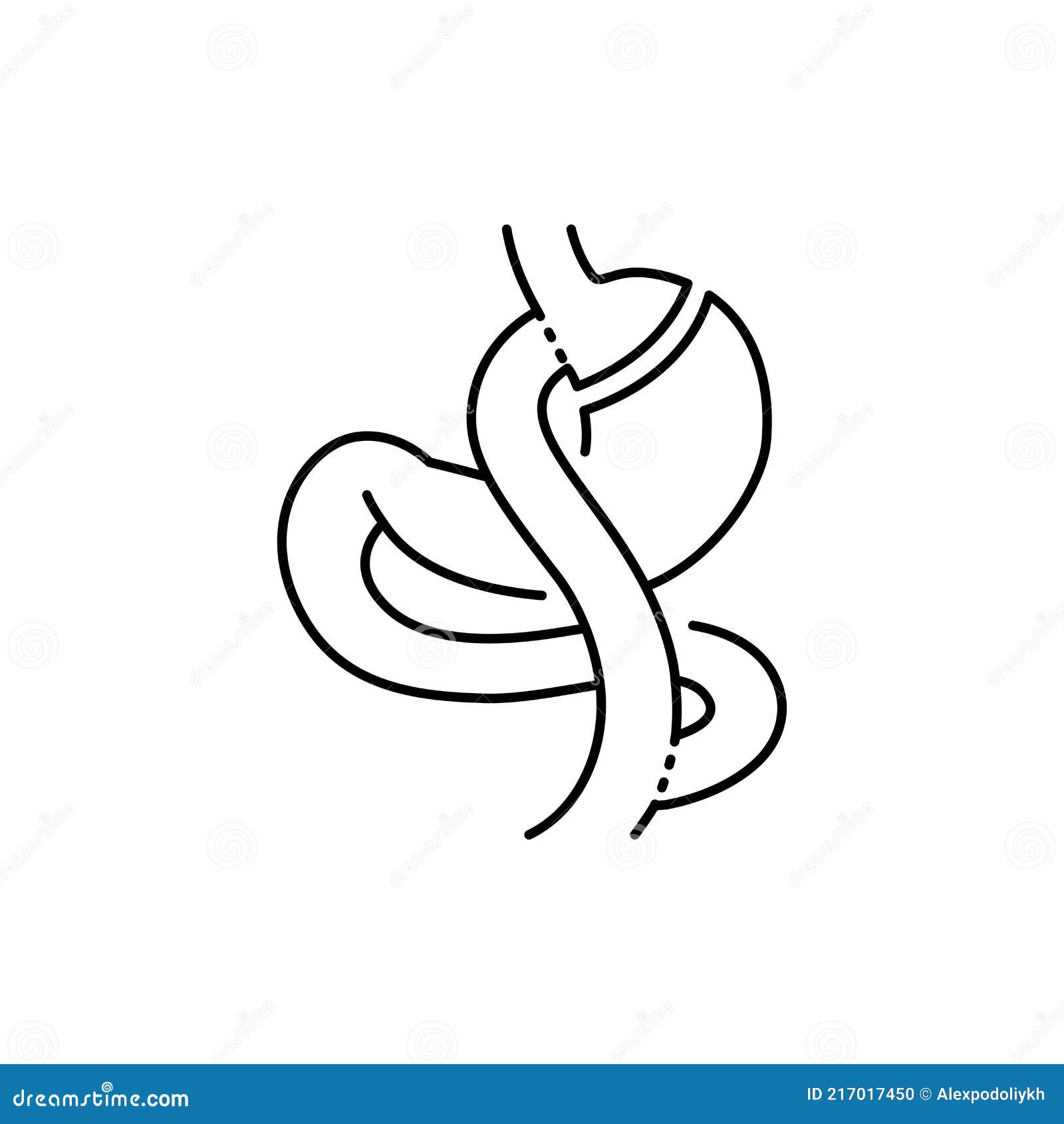 Gastric Bypass Surgery Vector Illustration 285475654