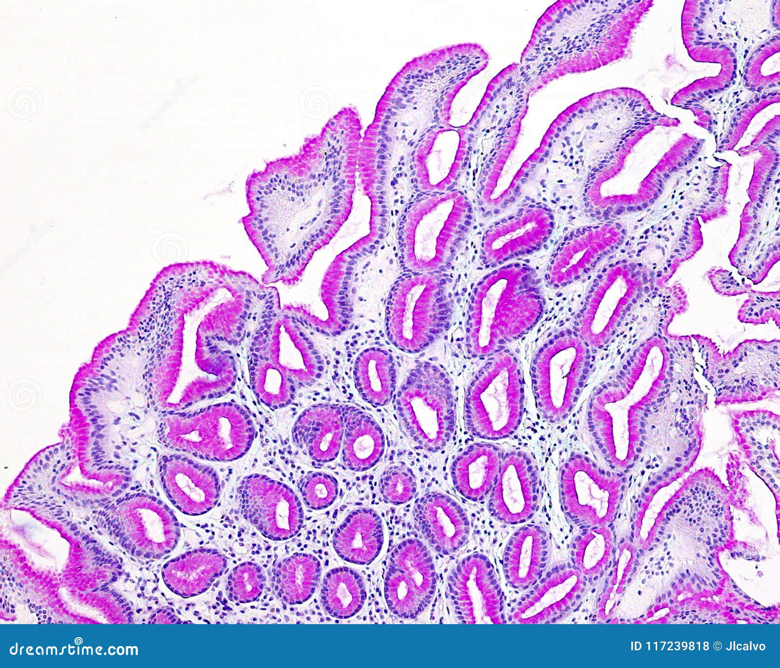 Surface Of Gastric Mucosa Royalty-Free Stock Image | CartoonDealer.com ...