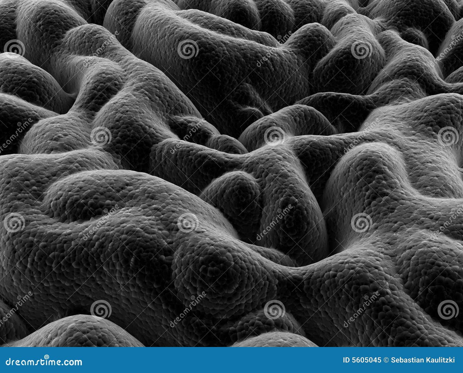 Gastric Mucosa In Polypous Gastritis. Infographics. Vector Illustration ...