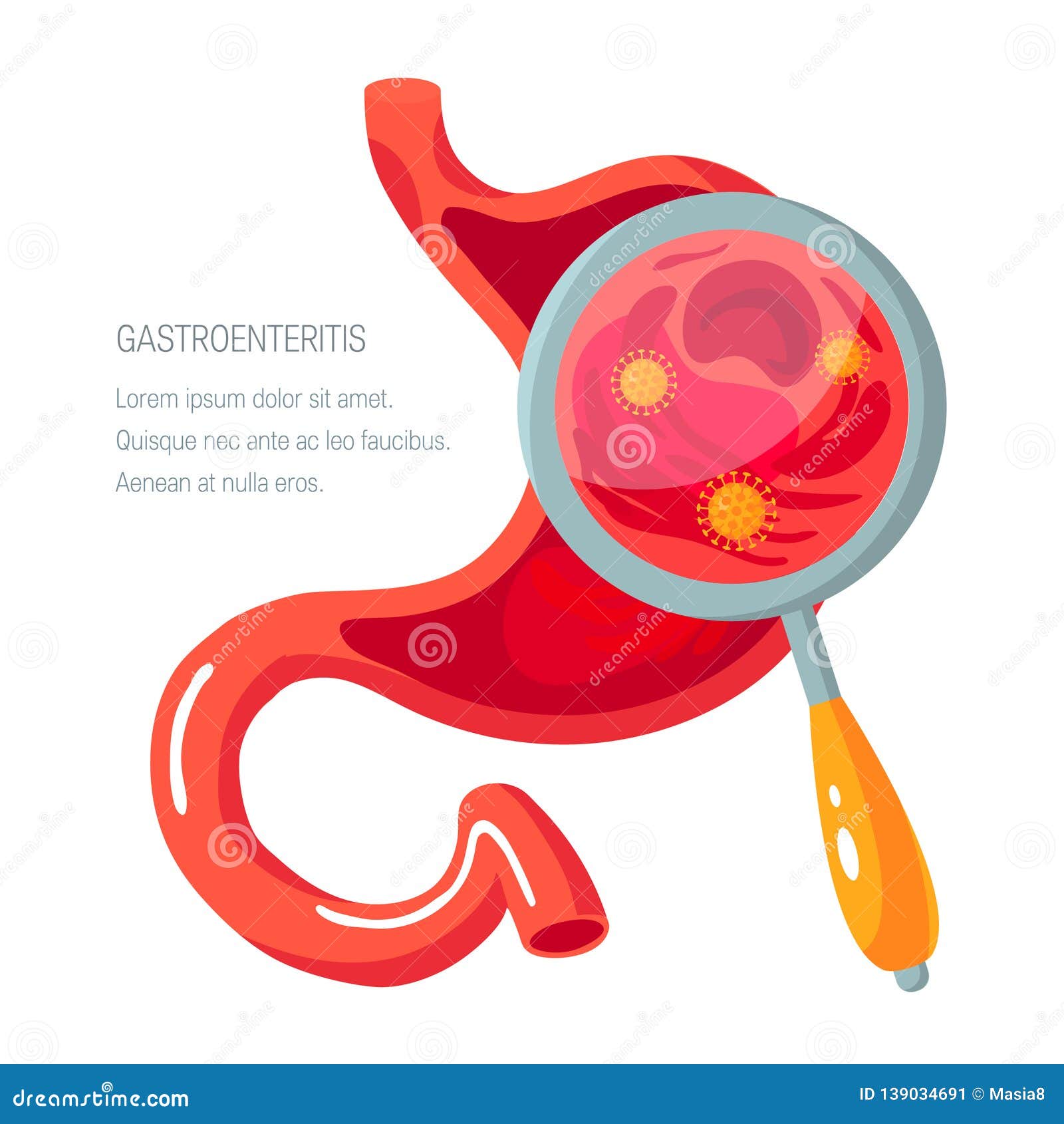 Gastroenteritis Vector Illustration. Labeled Stomach Inflammation ...