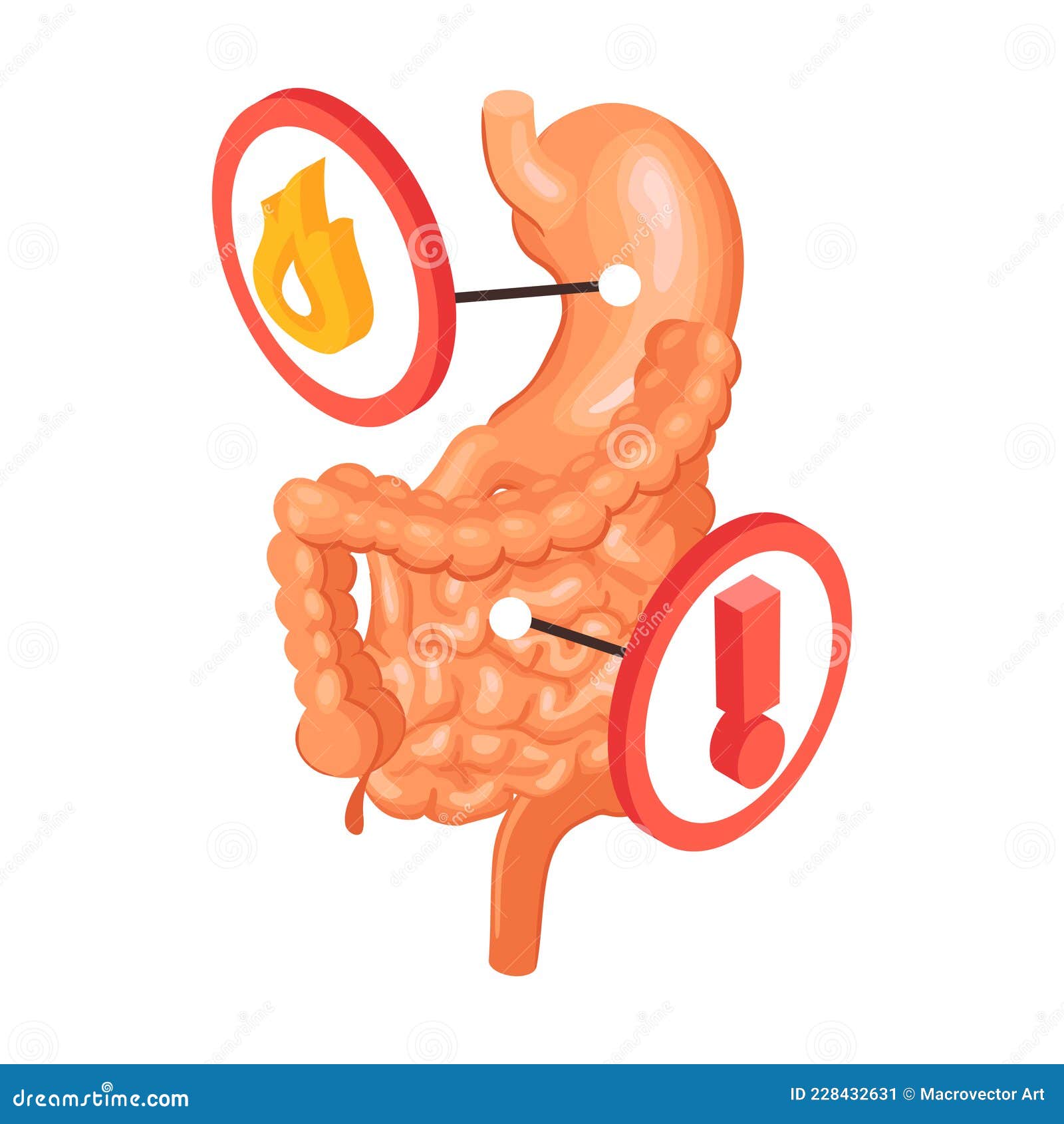 Gastroenterology Problems Finding Composition Cartoon Vector ...