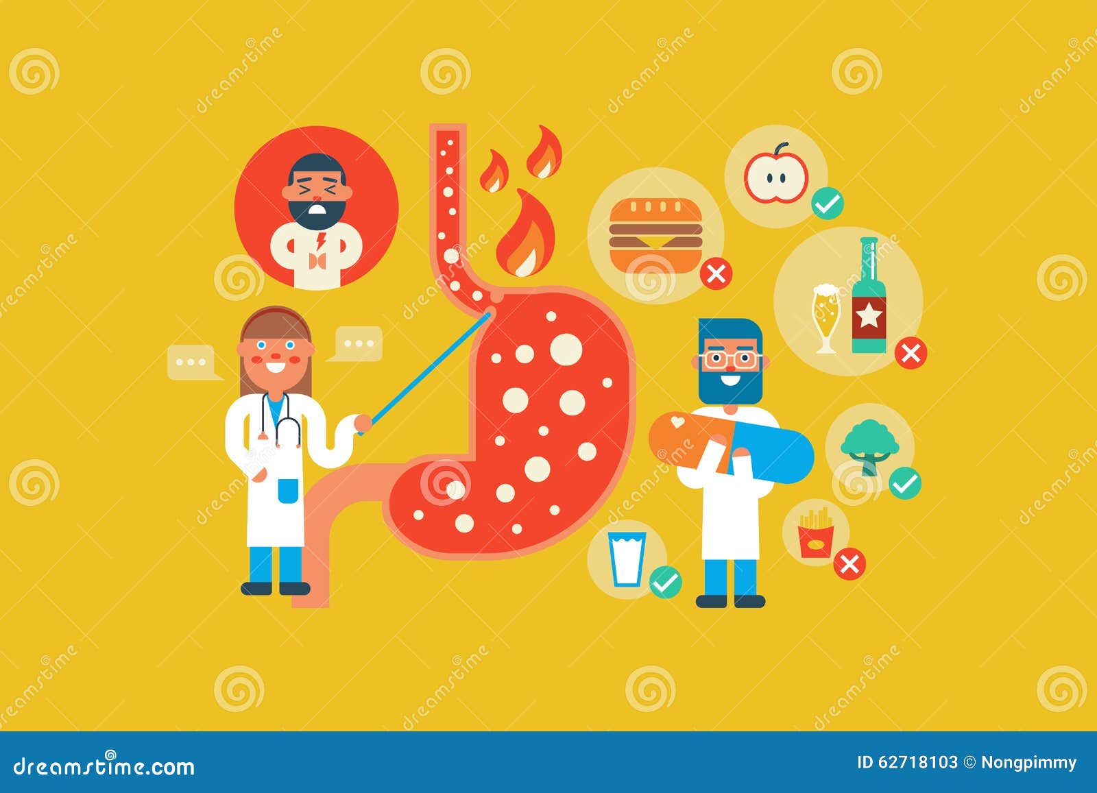 Gastroesophageal Reflux Disease Stock Vector - Illustration of ...
