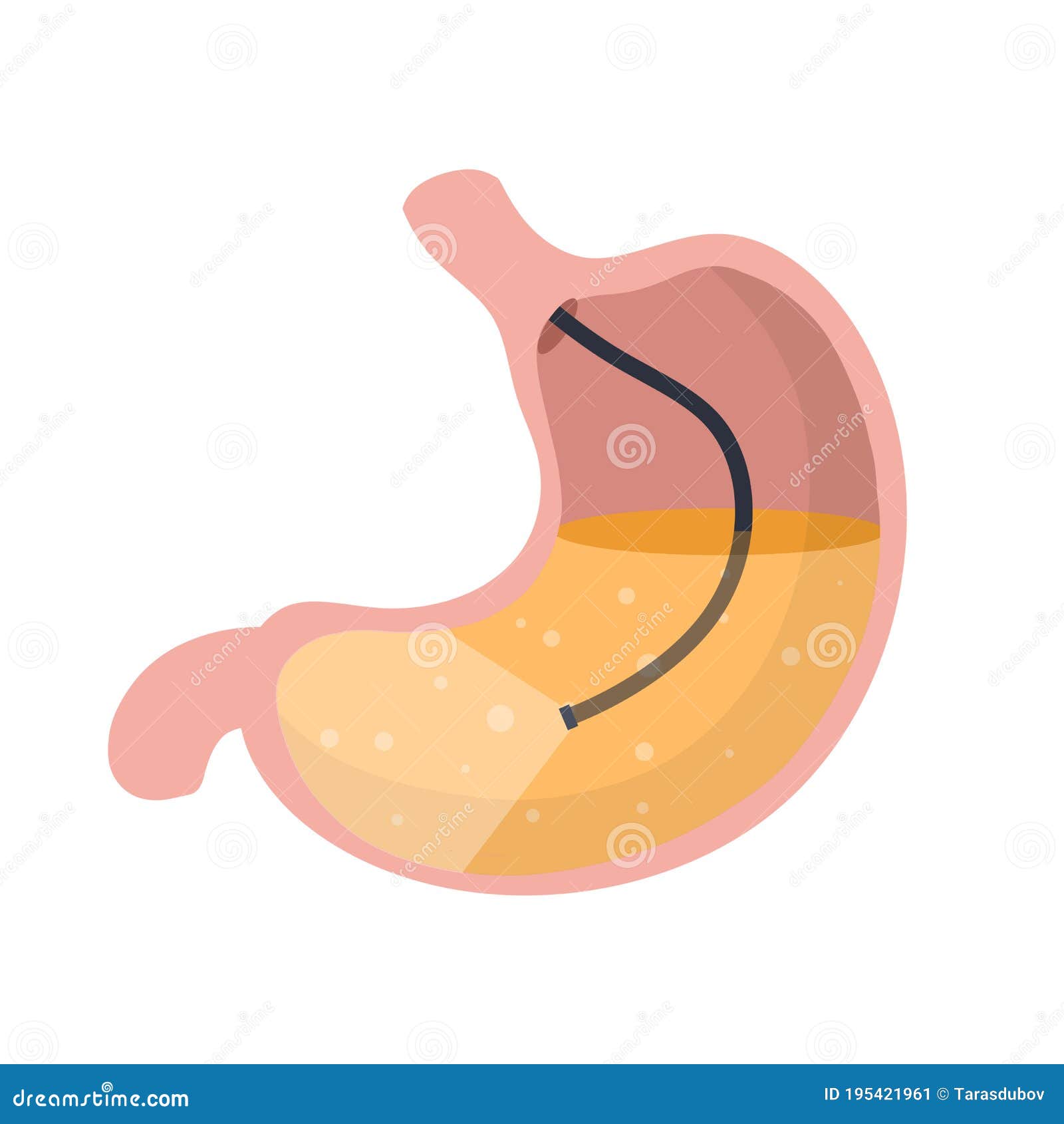 Gastroscopy. Endoscopy and Digestive Problems. Hose with Camera Stock ...