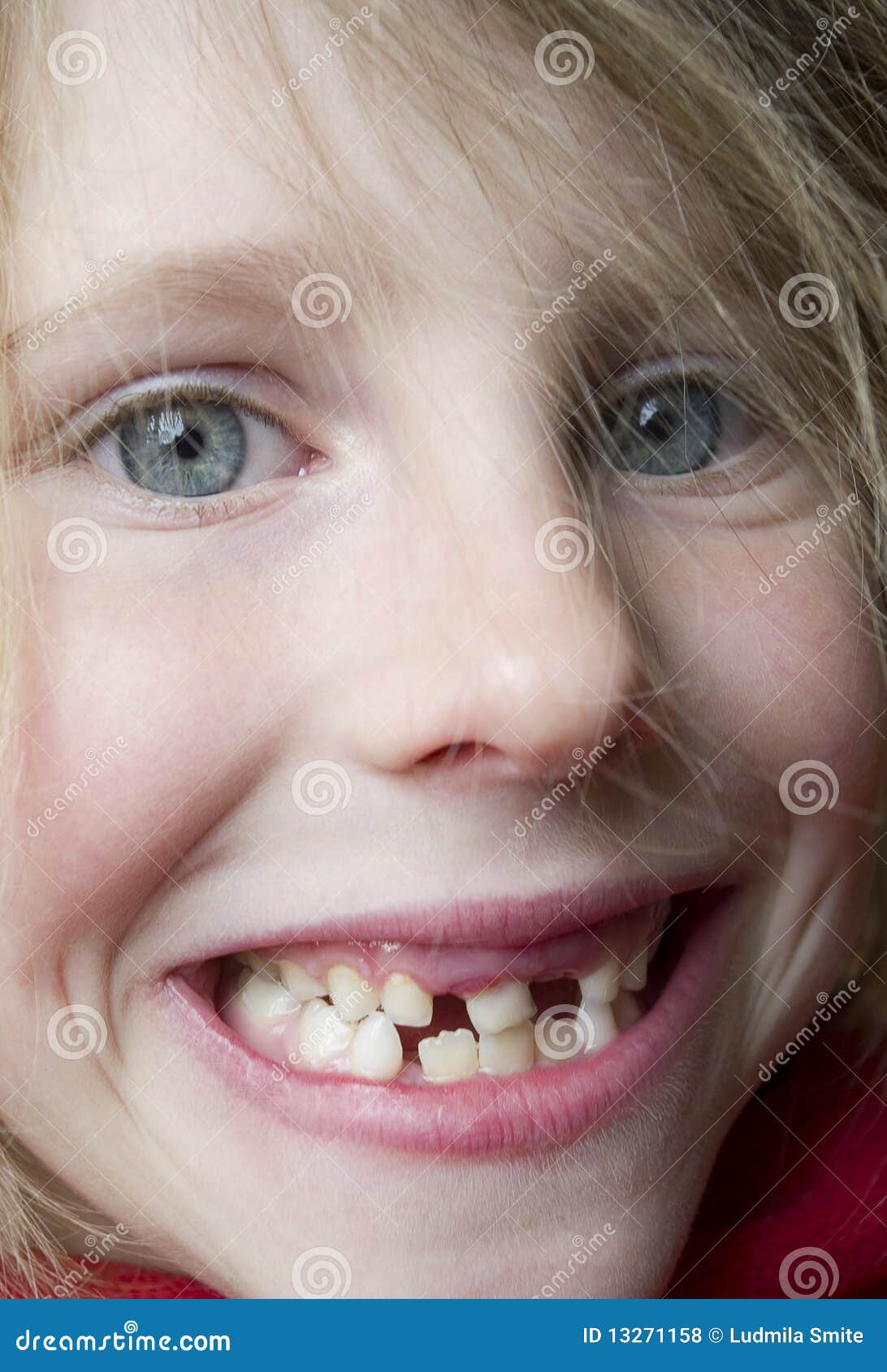 Gebiss. stockfoto. Bild von person, gesund, jung, zähne - 13271158