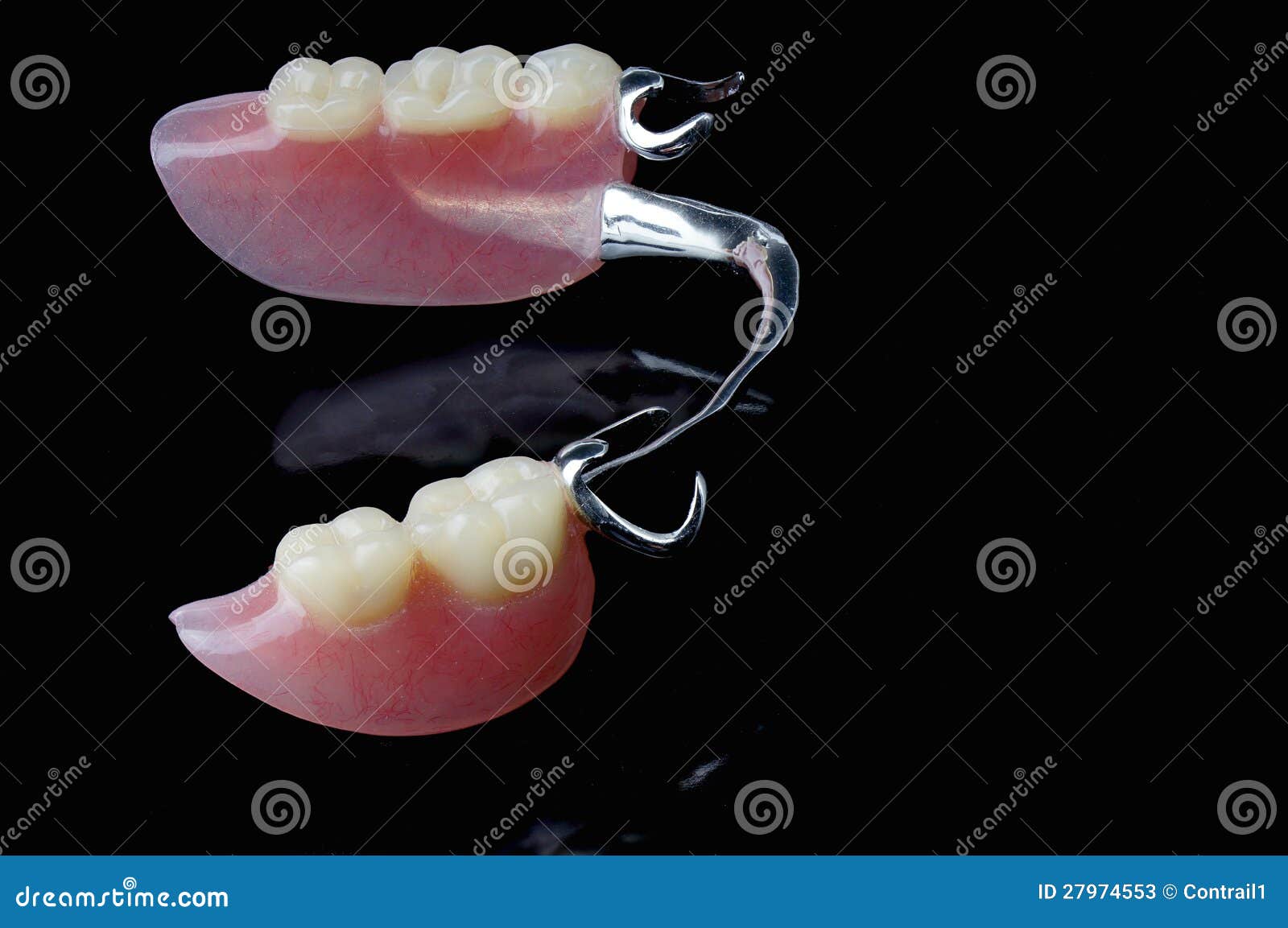 Gebiss stockbild. Bild von metall, obacht, stellvertreter - 27974553