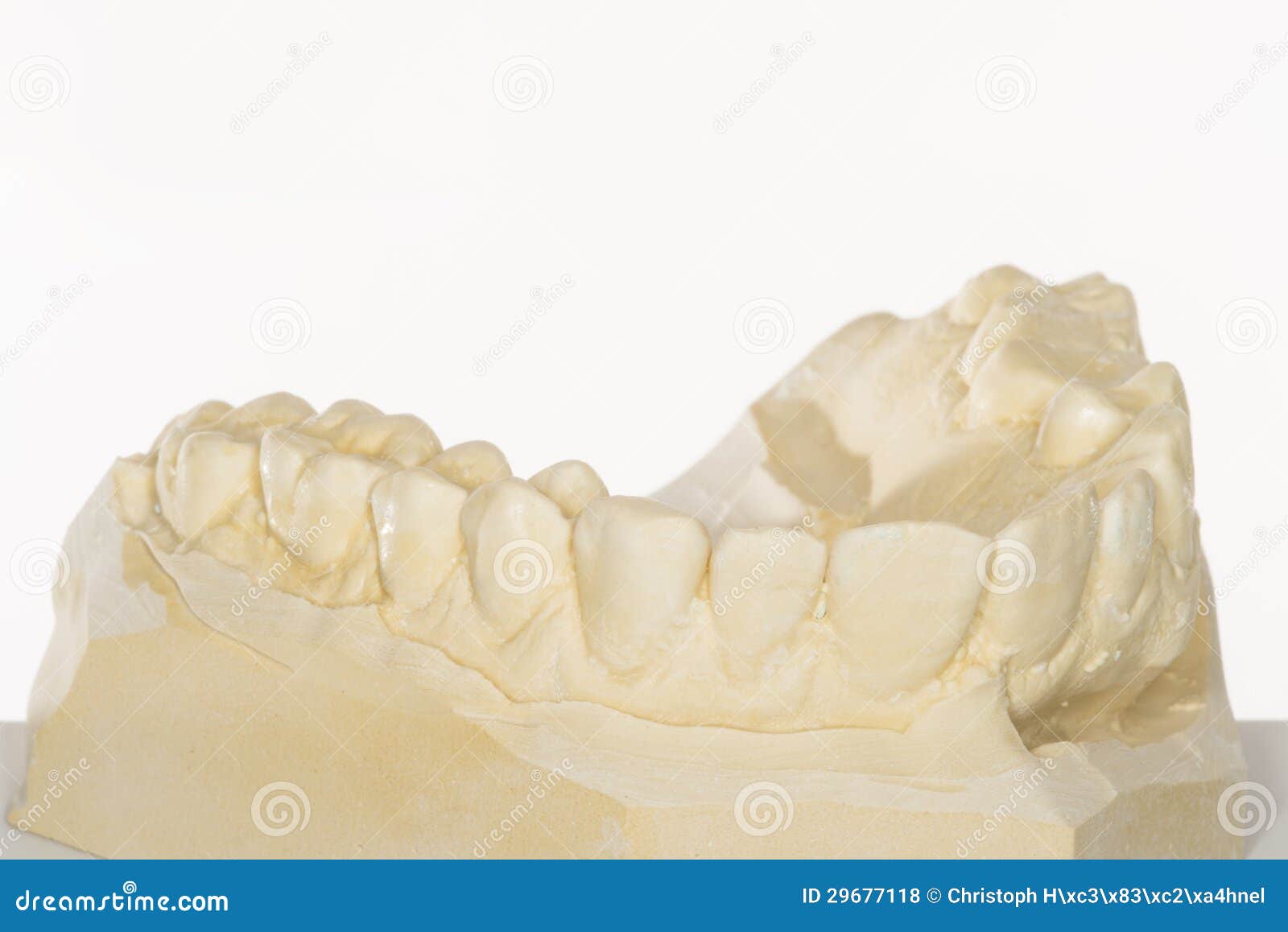 Gebiss stockfoto. Bild von mündlich, form, getrennt, eindruck - 29677118