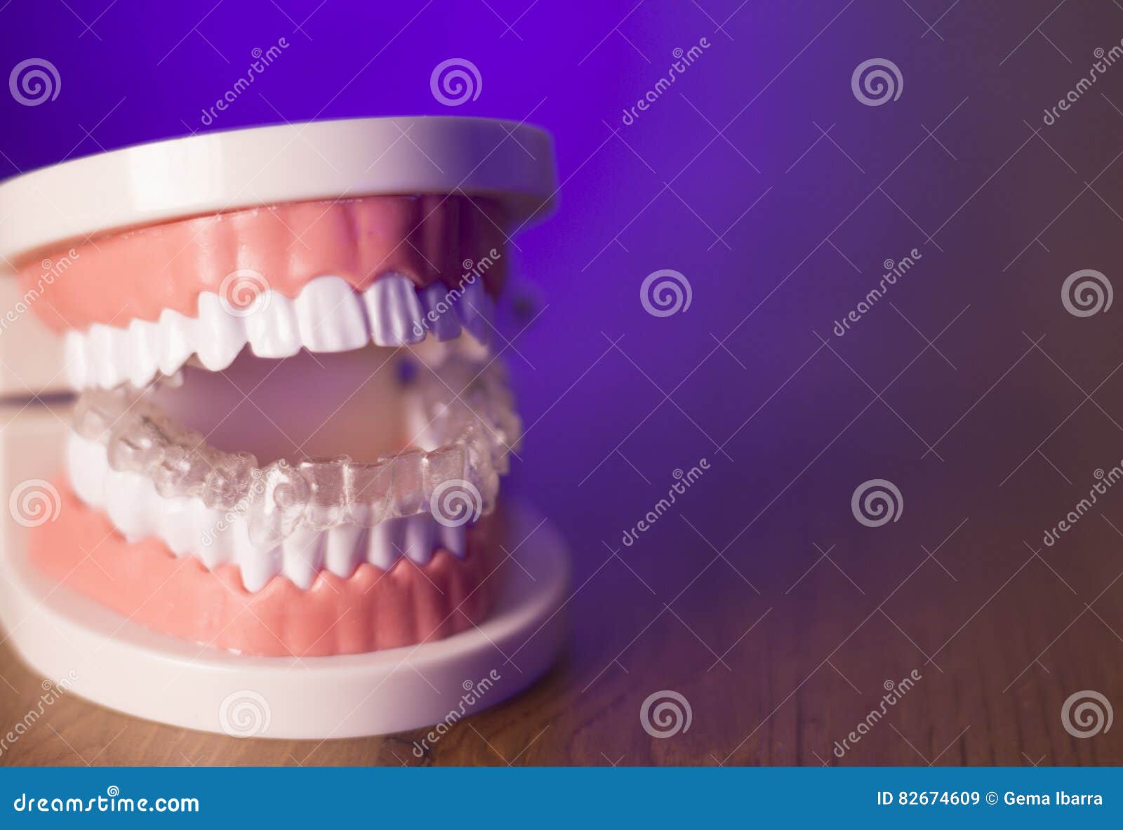 Gebit Met Transparante Orthodontie Stock Afbeelding - Image of ...