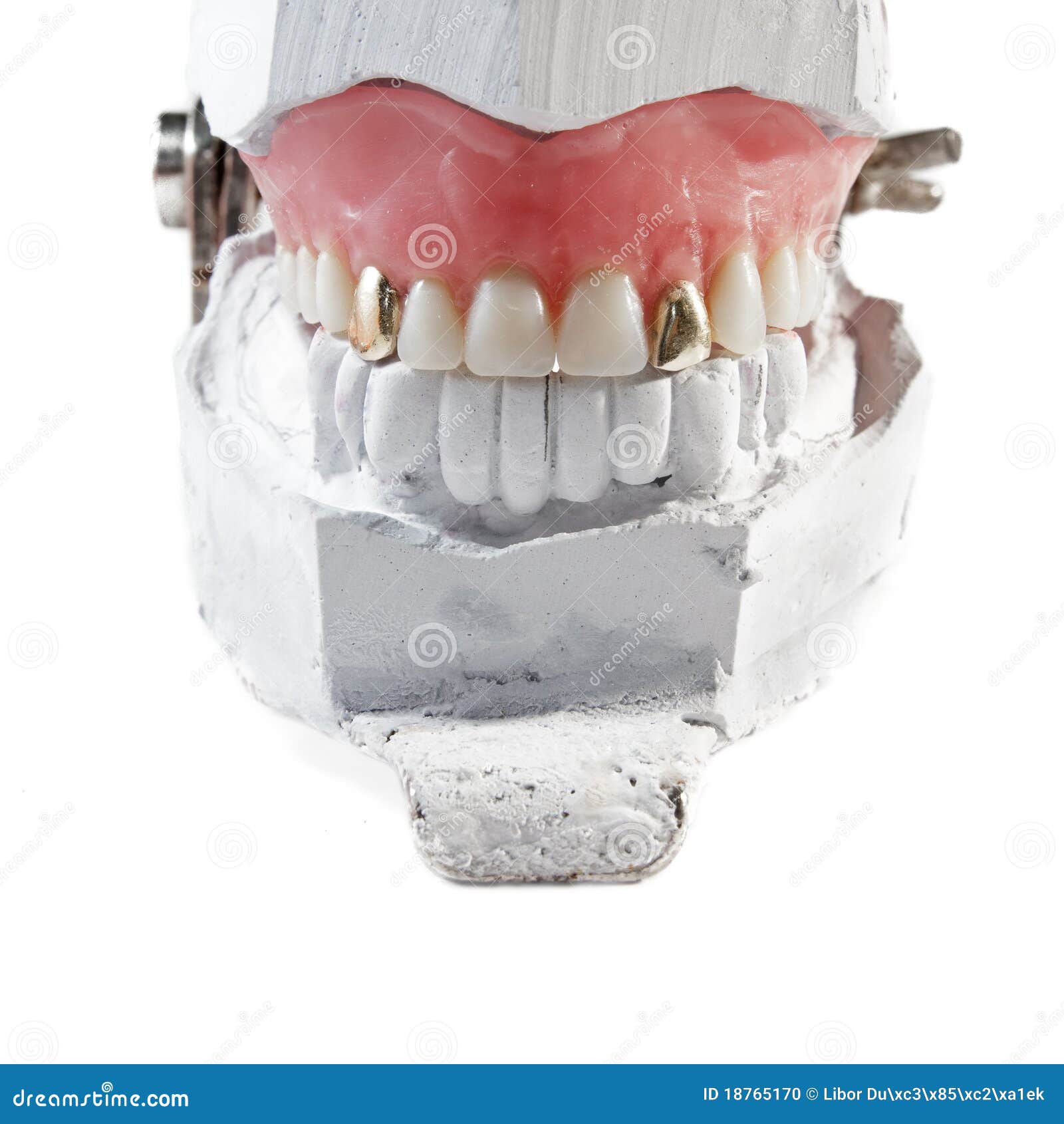 Jonge Schurk Gouden Tanden Dit Is Alles Wat Amal En George Clooney