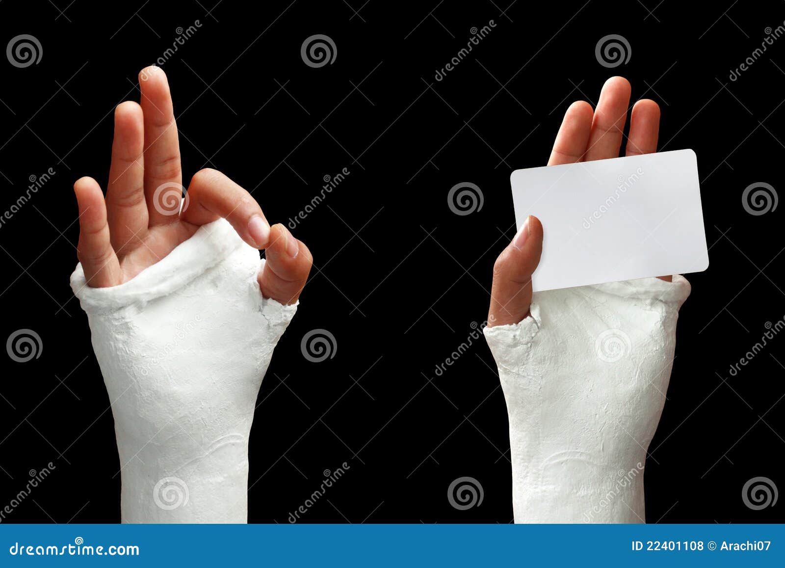 Gebrochener Arm - 03 stockfoto. Bild von syndrom, verletzen - 22401108