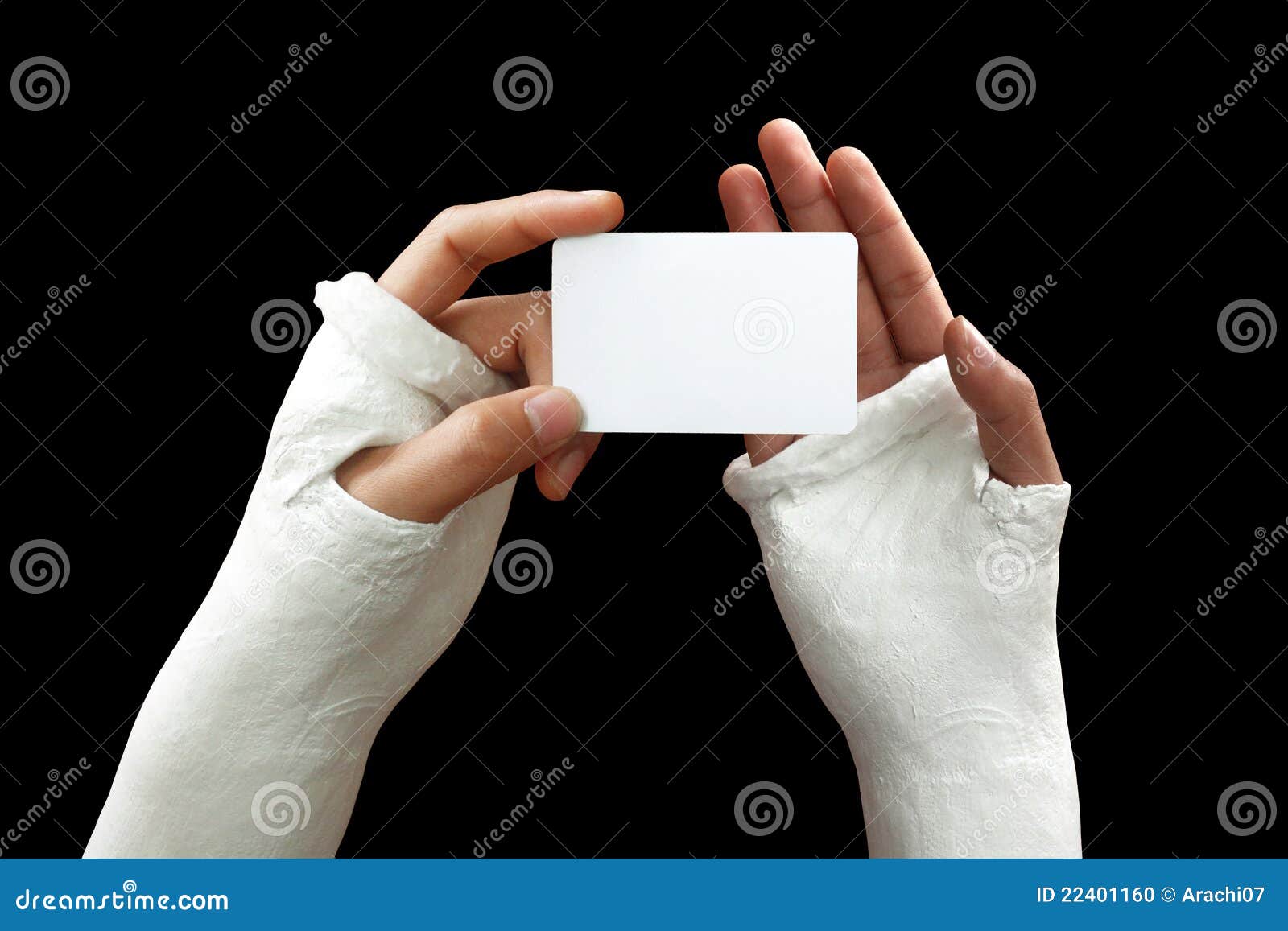 Gebrochener Arm - 05 stockfoto. Bild von untauglich, medizinisch - 22401160