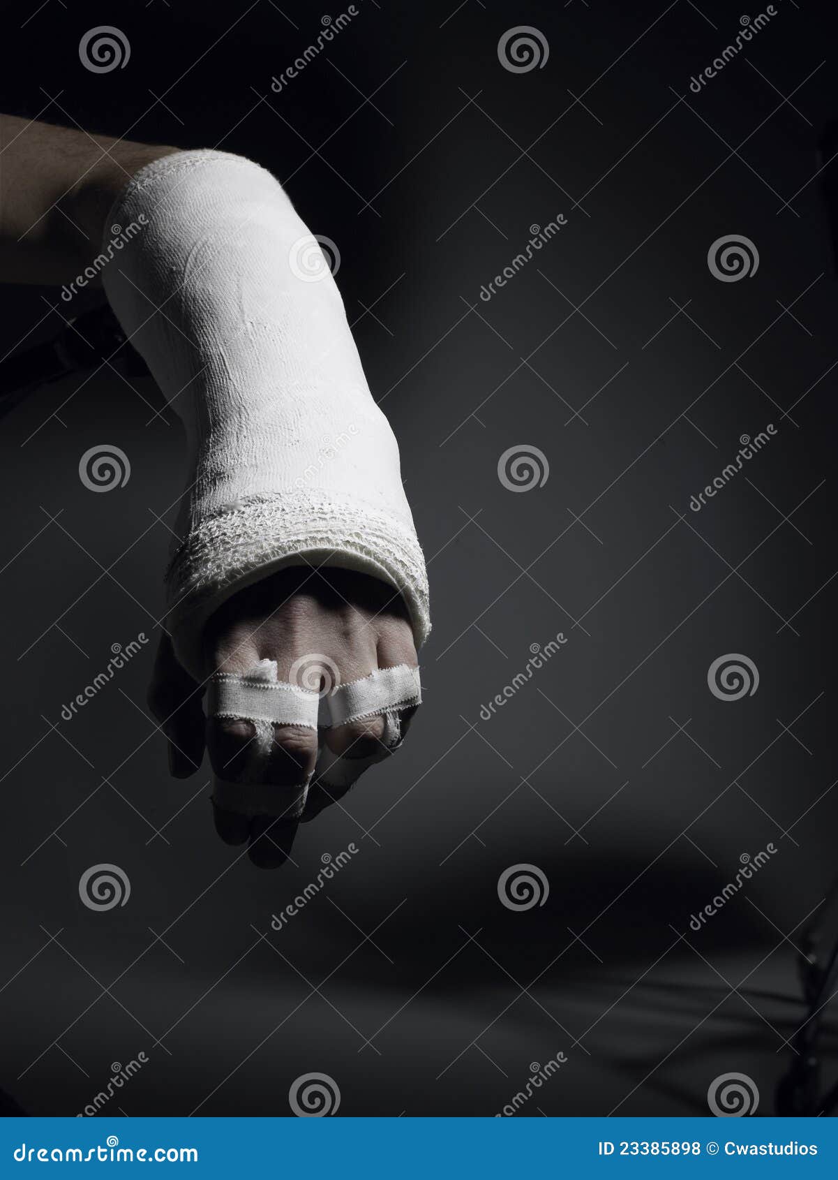 Gebrochener Arm und Finger stockfoto. Bild von industriell - 23385898