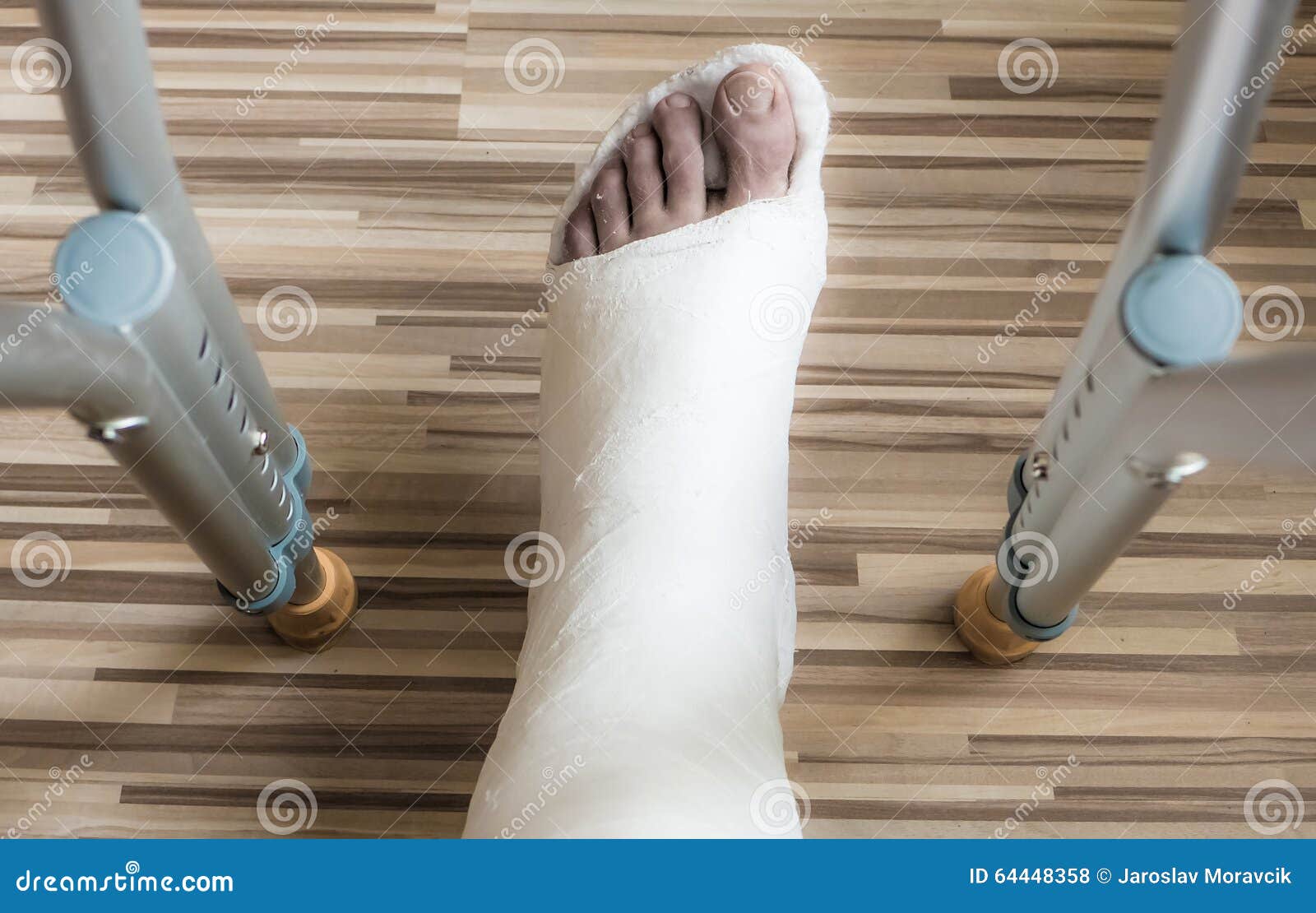 Gebroken Enkel En Steunpilaren Stock Foto - Image of behandeling ...