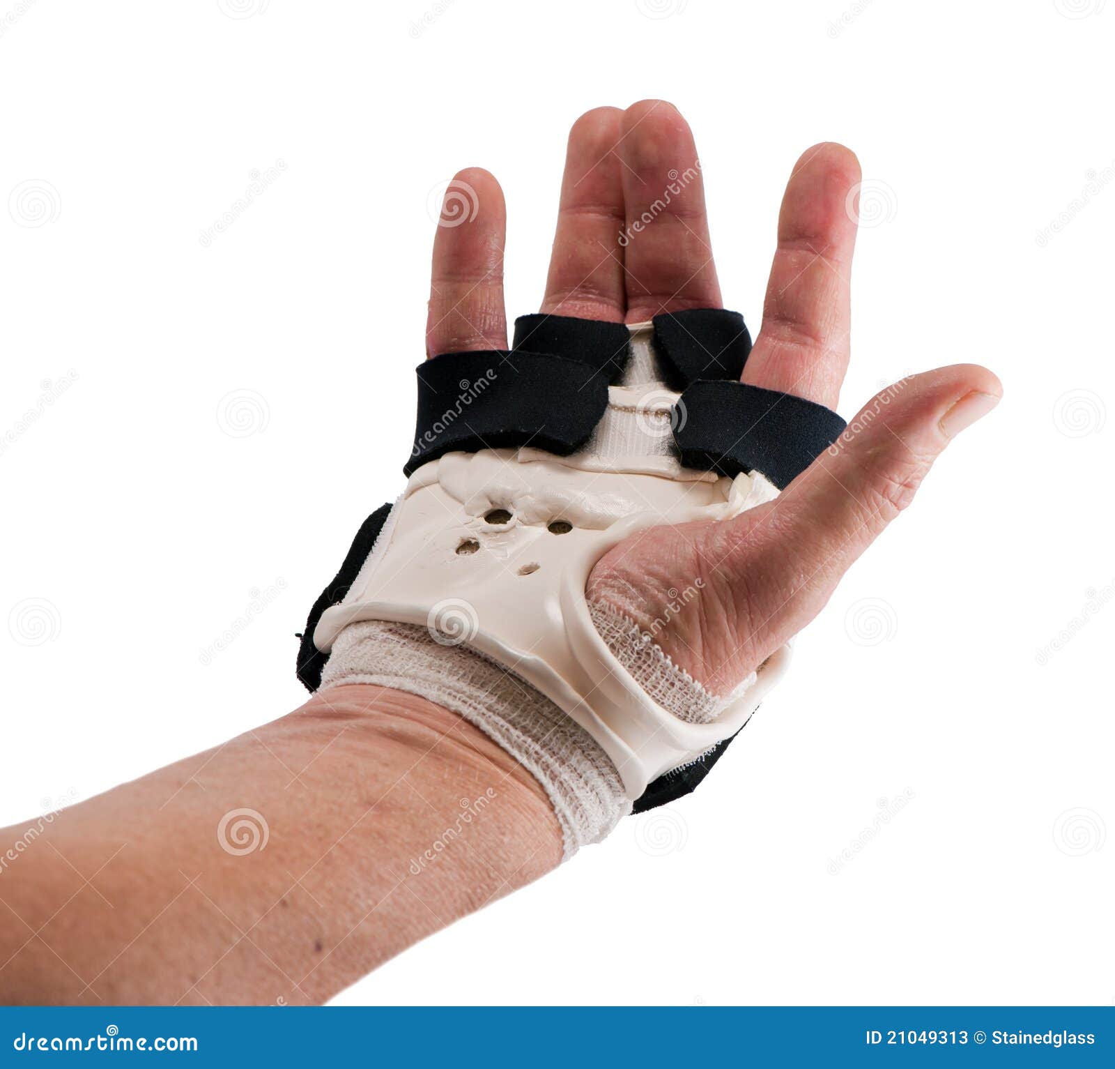 Gebroken Hand stock afbeelding. Image of rehabilitatie - 21049313