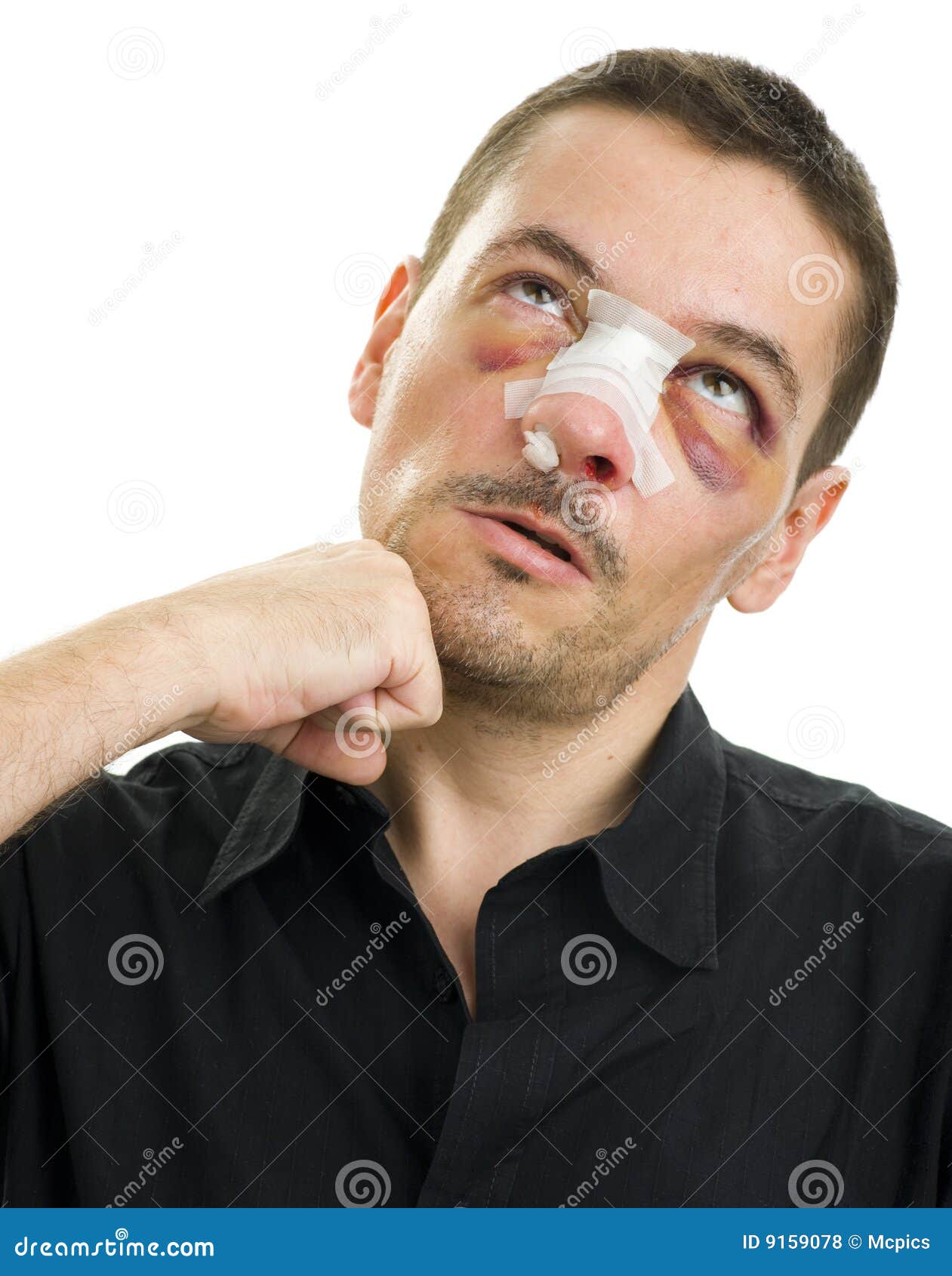 Gebroken Neus Postverrichting Stock Foto - Image of knockout ...