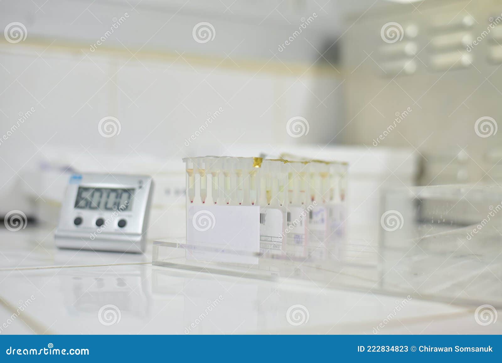 Gel Colume Agglutination in Blood Bank Laboratory Stock Image - Image ...