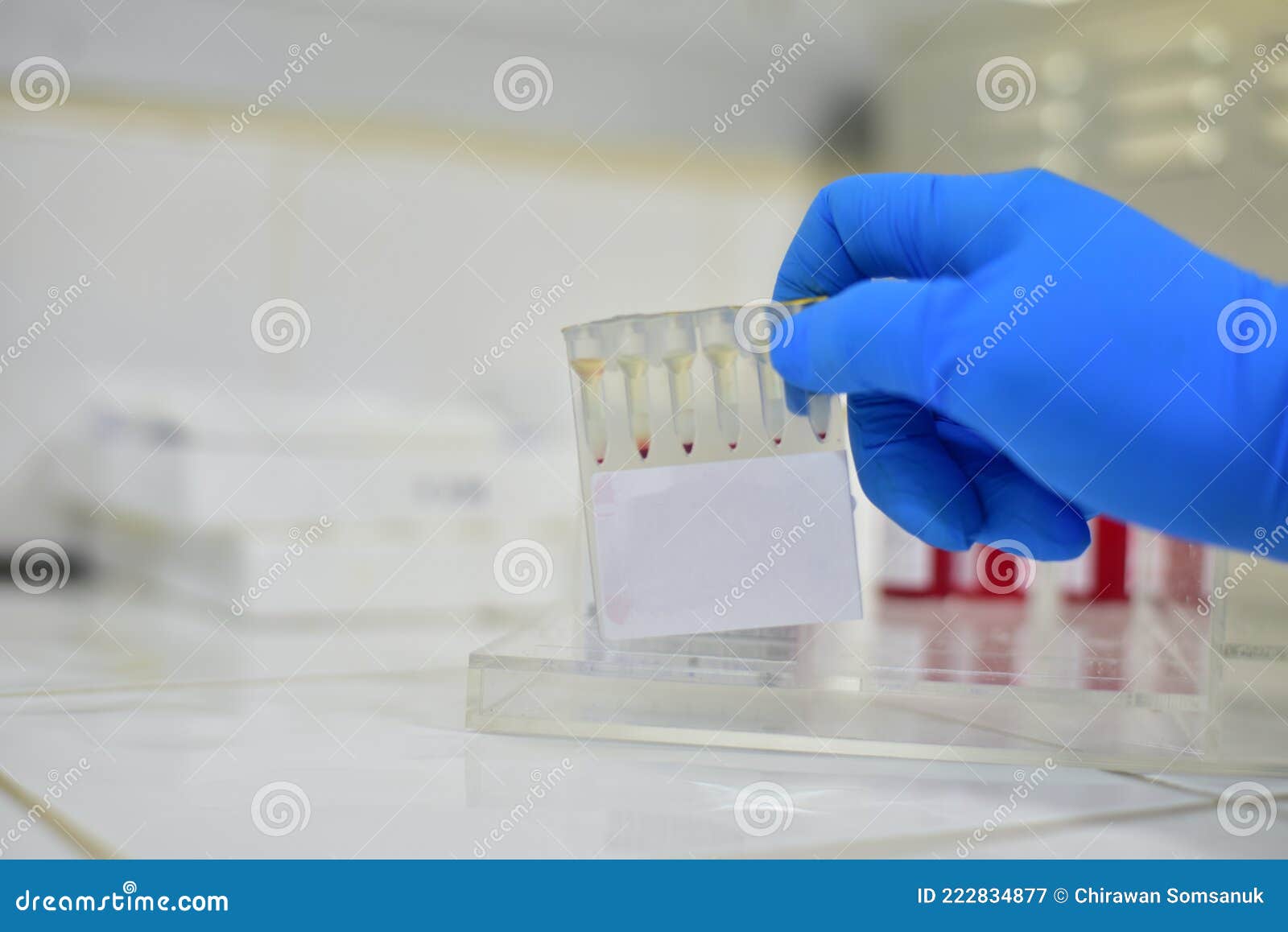 Gel Colume Agglutination in Blood Bank Laboratory Stock Image - Image ...