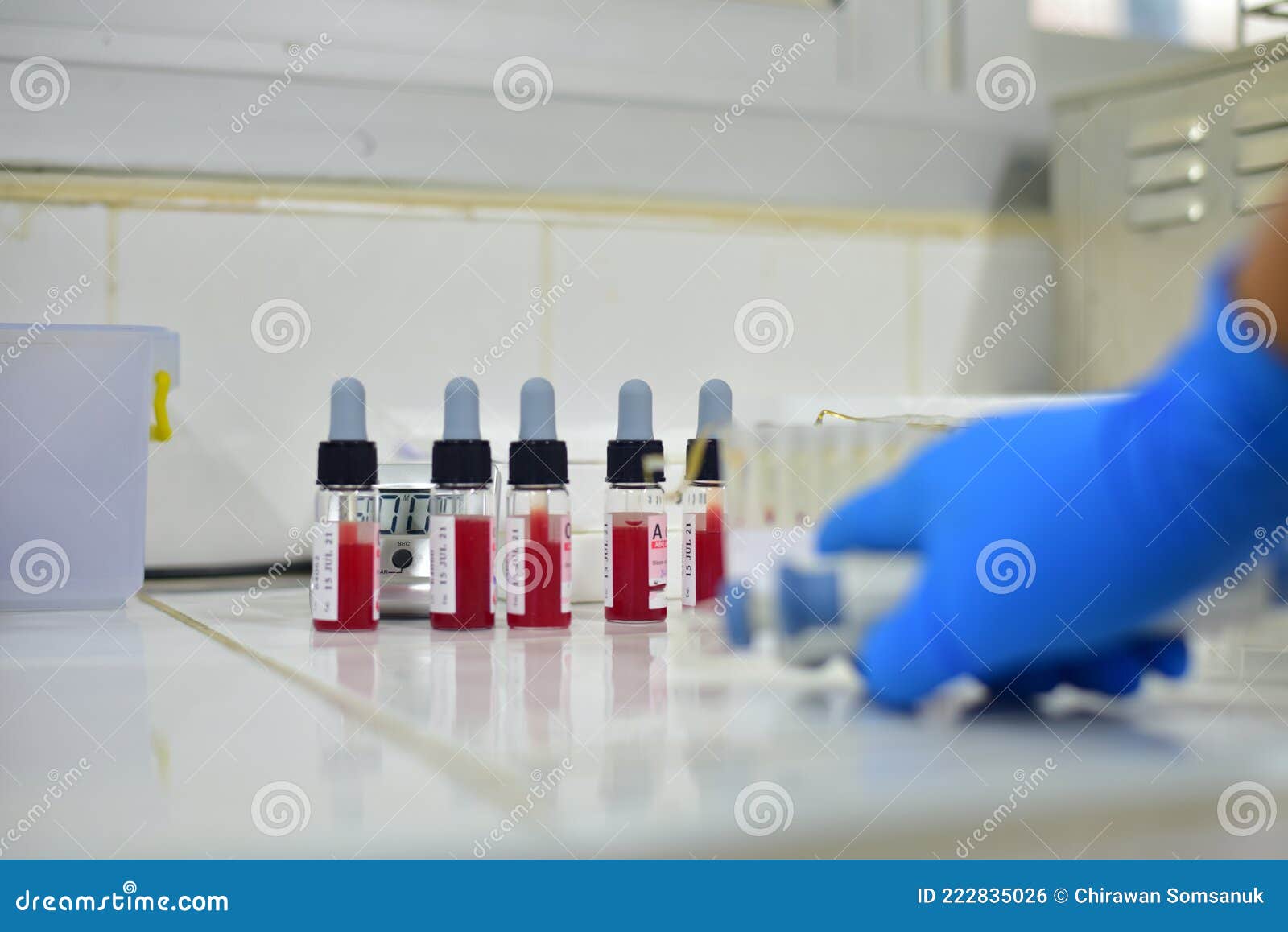 Gel Colume Agglutination in Blood Bank Laboratory Stock Photo - Image ...