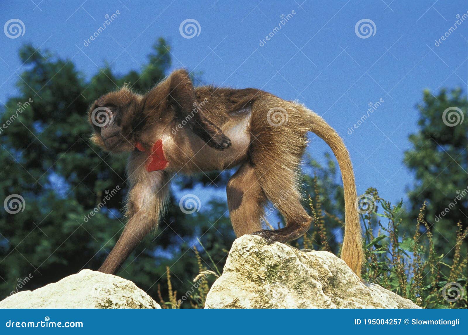 Female Scratching Her Itchy Arm With Allergy Rash Royalty-Free Stock ...