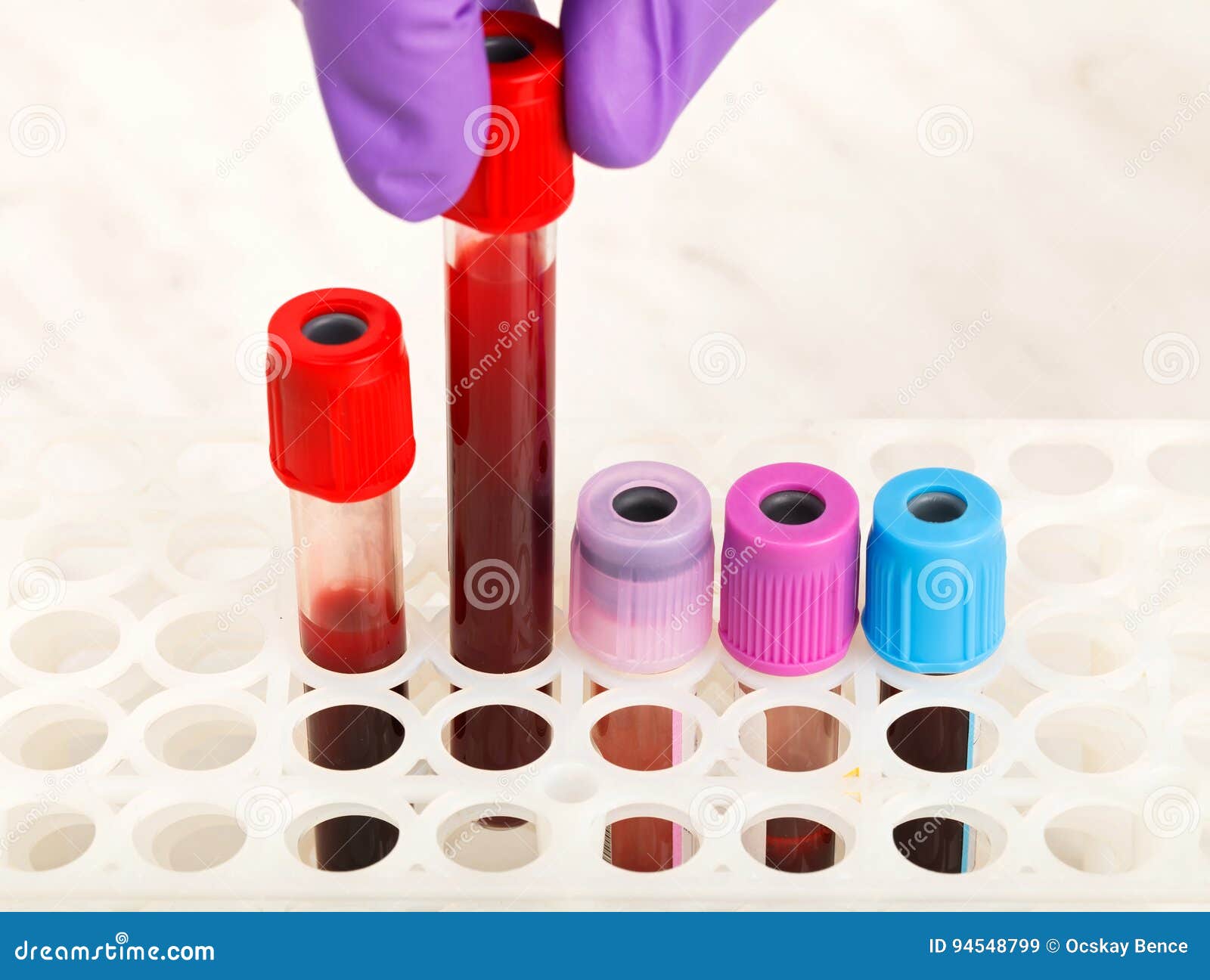 General blood test stock image. Image of care, healthcare - 94548799