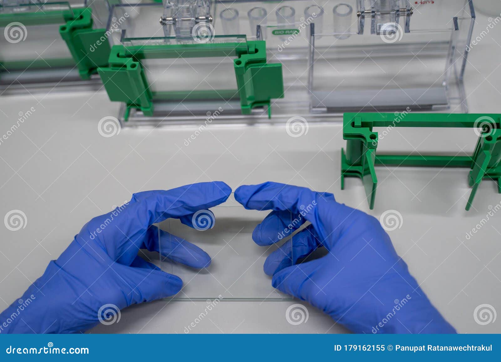 Using western blot technique - frosden