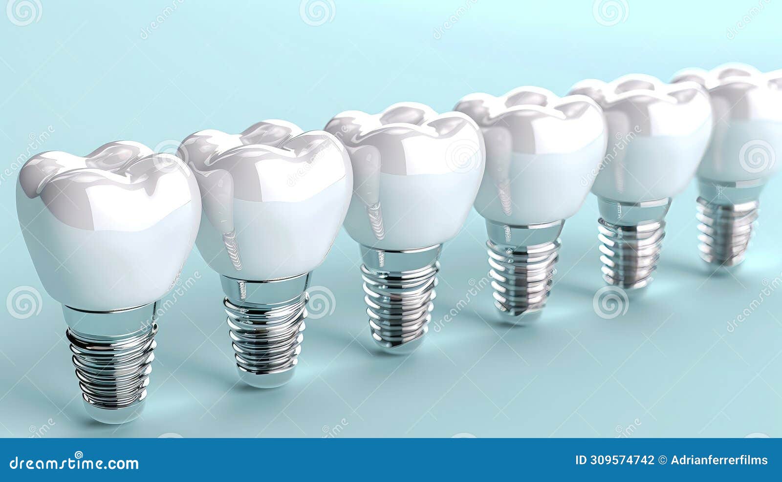 Multiple Dental Implants Displayed in a Row, Symbolizing Precision in ...