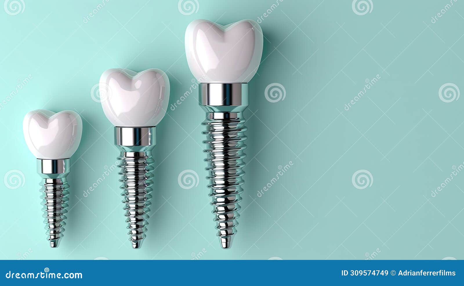 Three Dental Implants on a Teal Background, Showcasing Modern Tooth ...