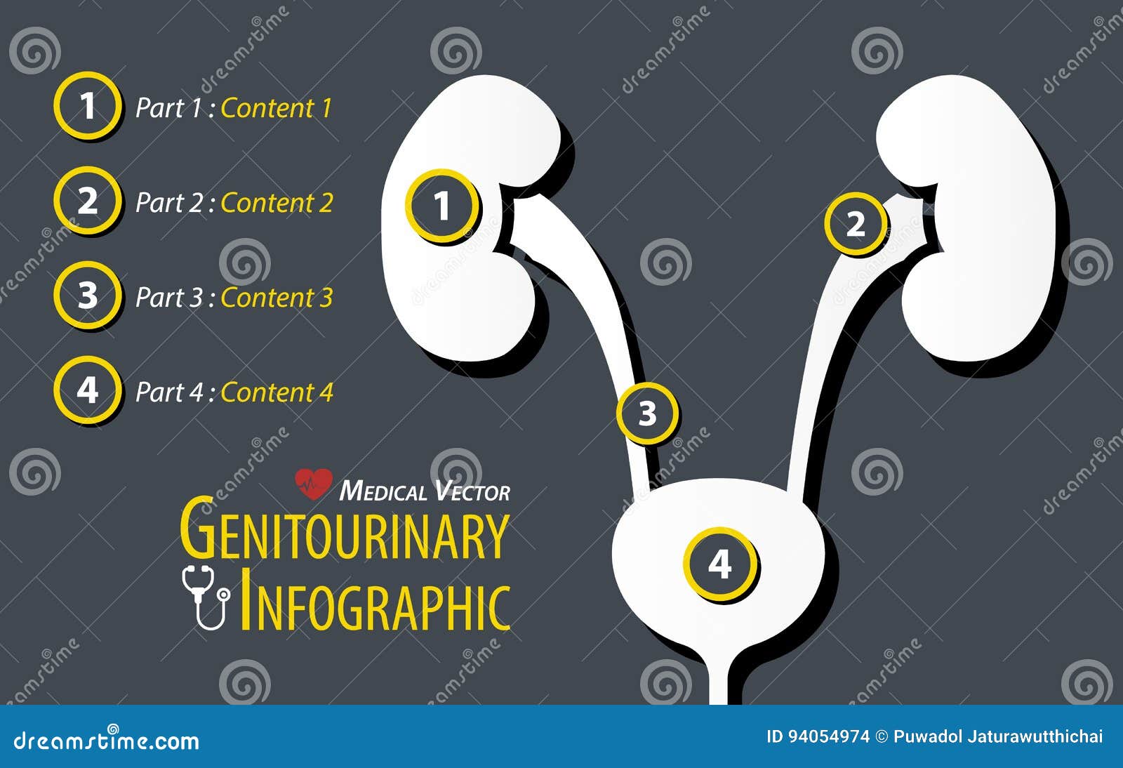 Genitourinary Infographic . Flat Design Stock Vector - Illustration of ...