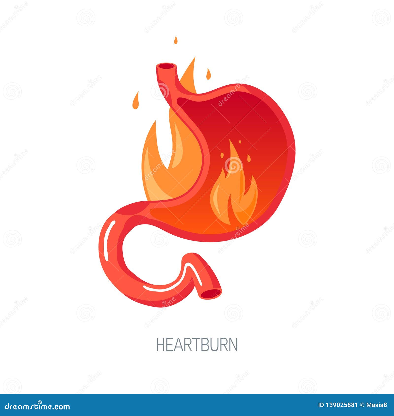 GERD Concept in Flat Style, Illustration Stock Illustration ...