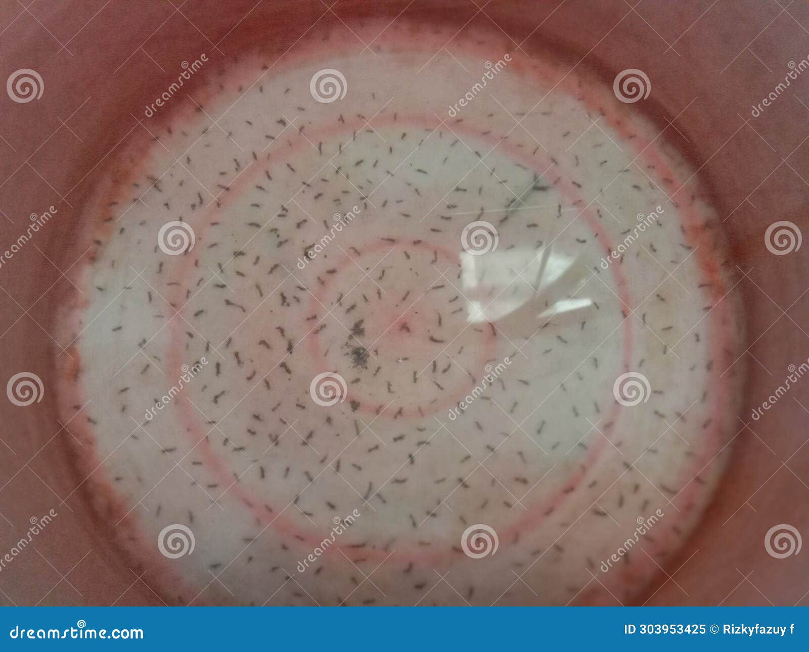 Germs in the bucket?? stock image. Image of bucketin - 303953425