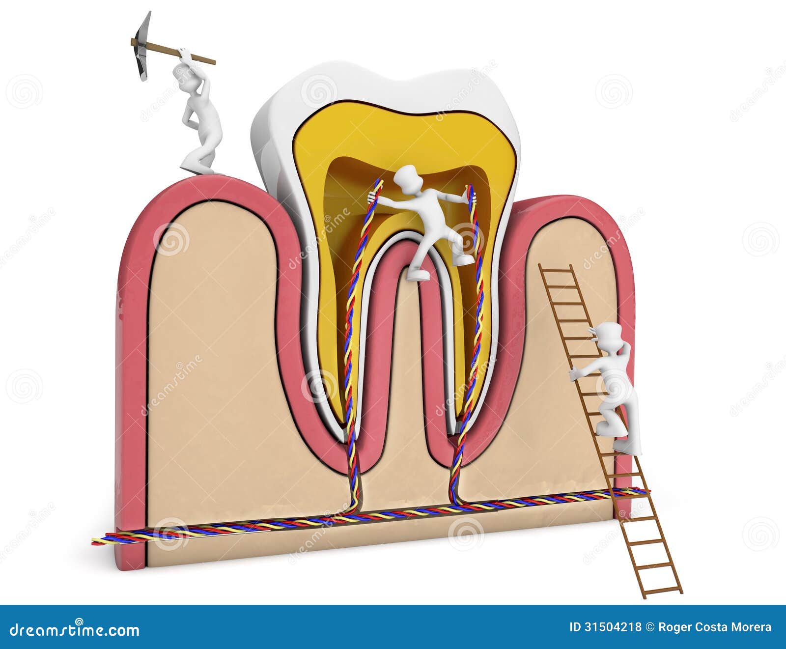 Drilling Tooth With Dentist's Instrument Silhouette Icon. Dentist ...