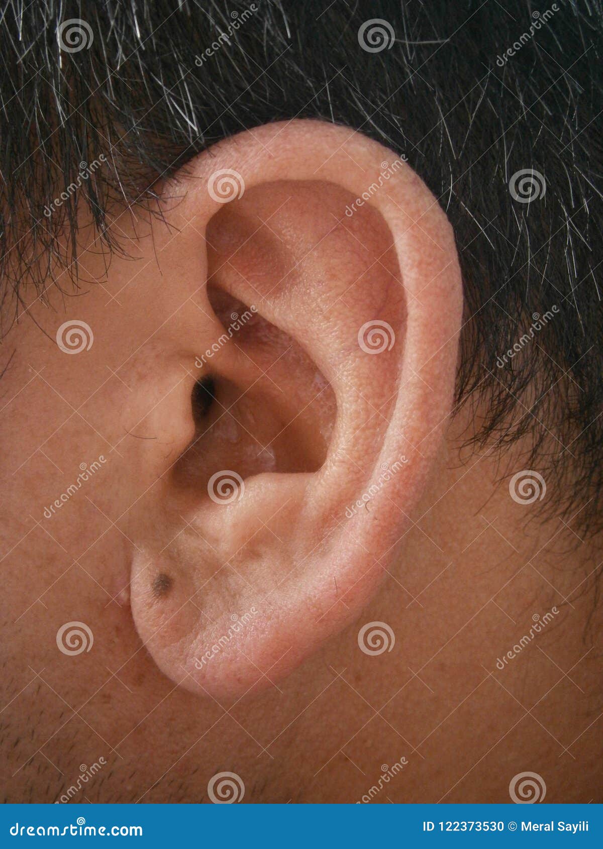 Gesunde Seitenansicht Des Ohrs Stockfoto - Bild von kaukasisch, farbe ...