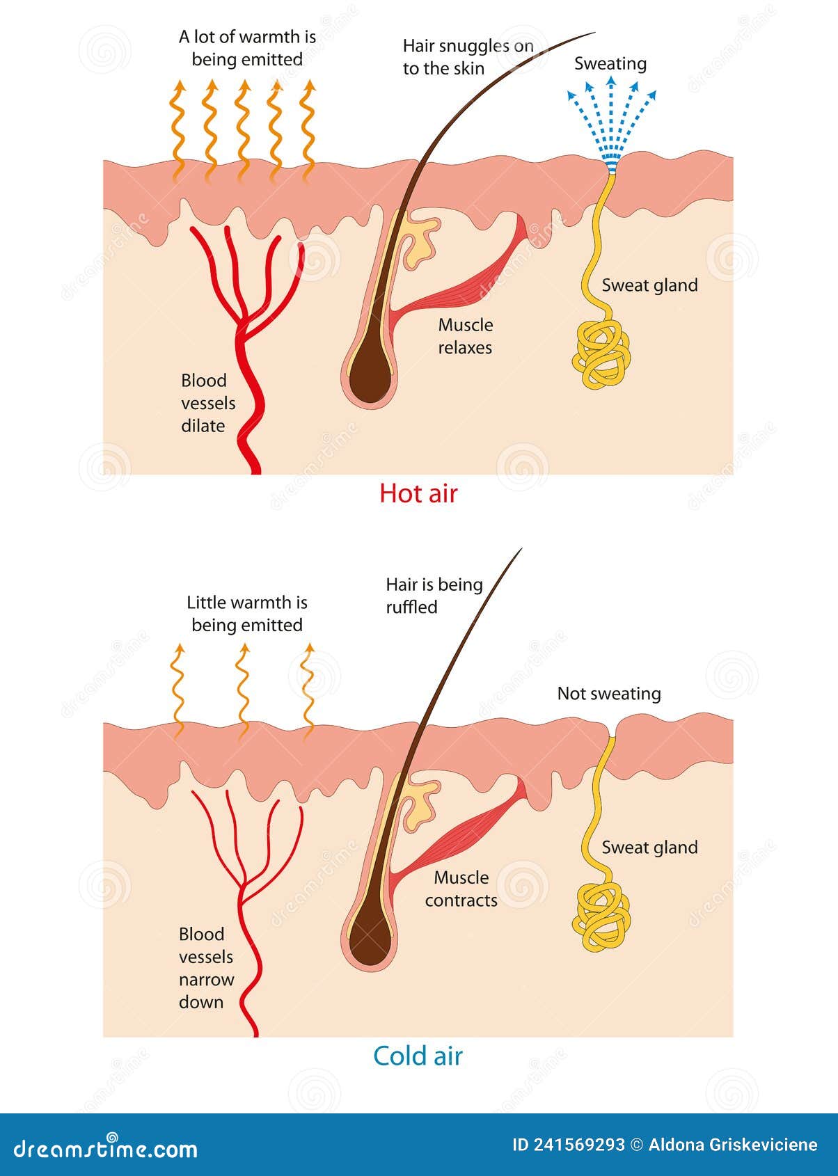 Skin Mechanism Of Blotches Cartoon Vector | CartoonDealer.com #71939071 Skin Mechanism Of Blotches Cartoon Vector | CartoonDealer.com #71939071