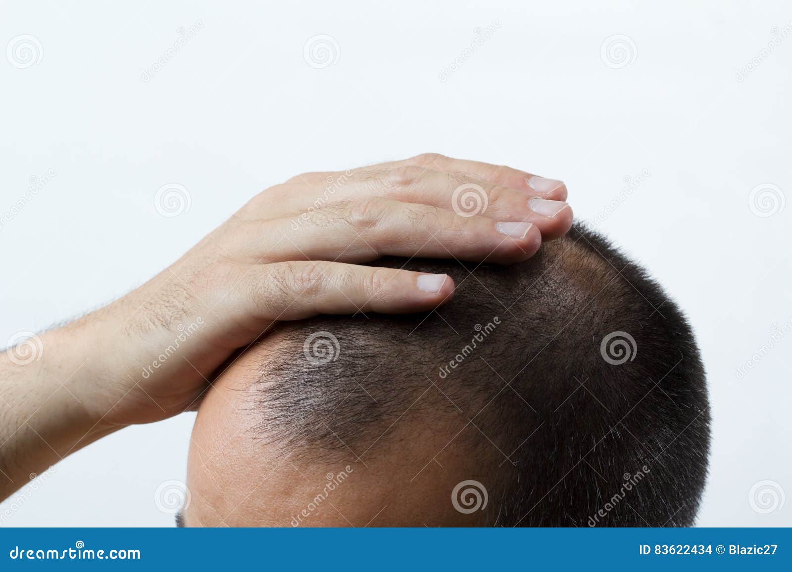 8,486 Bald Men Photos - Free & Royalty-Free Stock Photos from ...