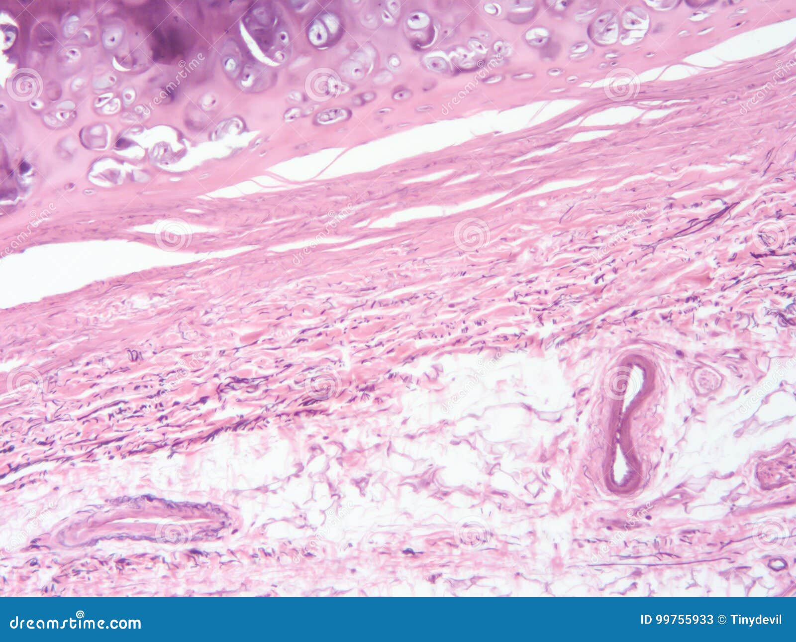 Gewebelehre Des Knorpelmenschengewebes Stockbild - Bild von verbindend ...