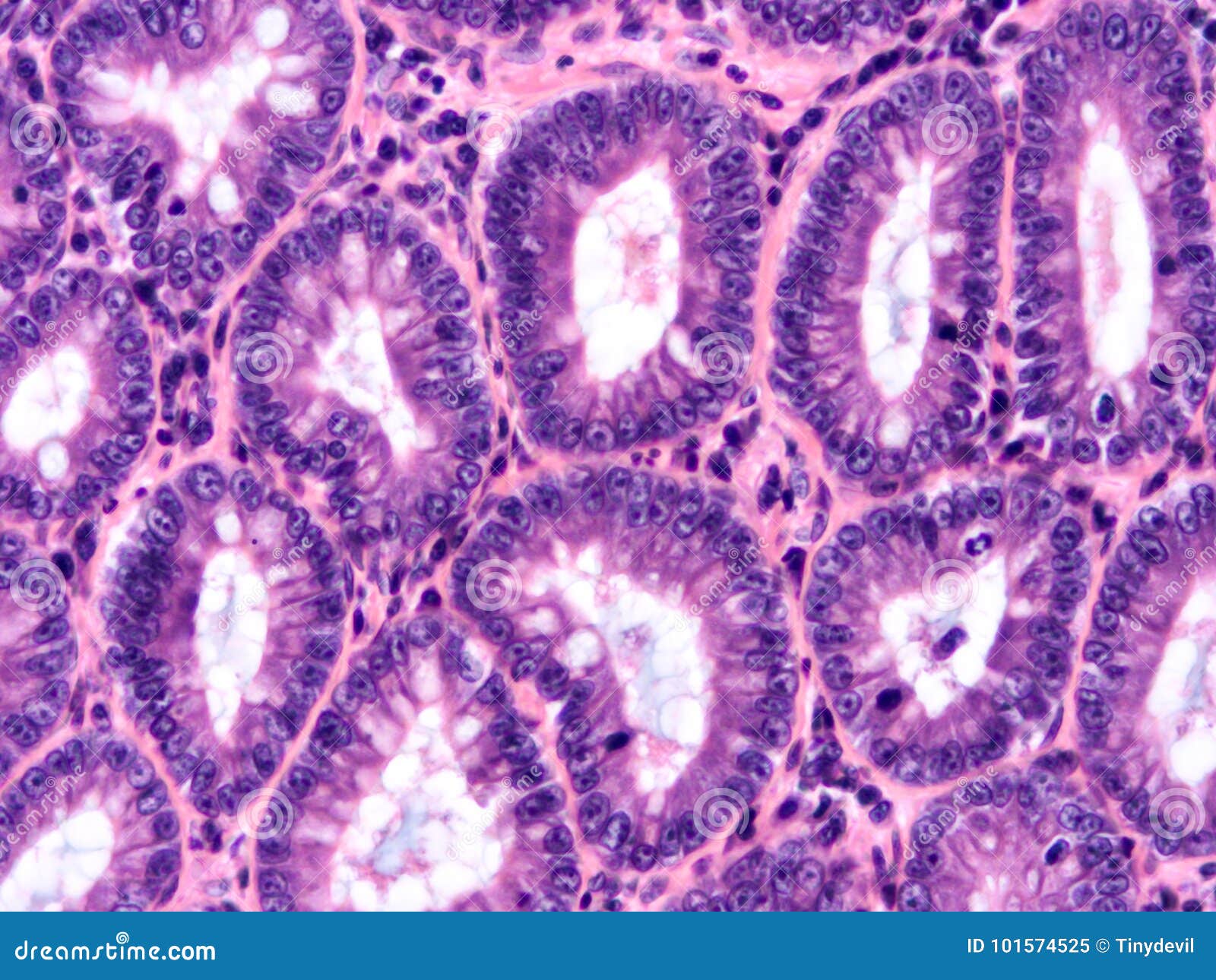 Gewebelehre Des Menschlichen Gewebes Stockbild - Bild von kern ...