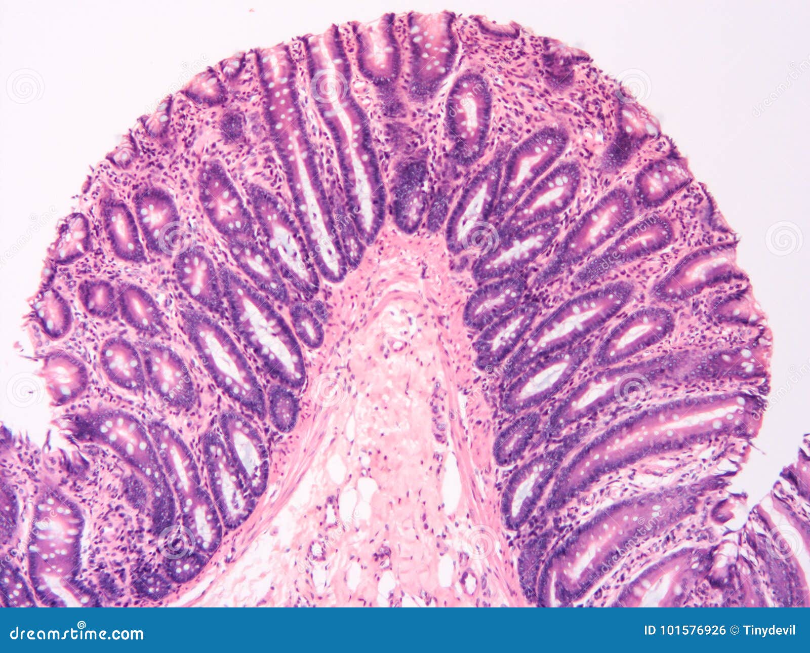 Gewebelehre Des Menschlichen Gewebes Stockfoto - Bild von gewebe ...