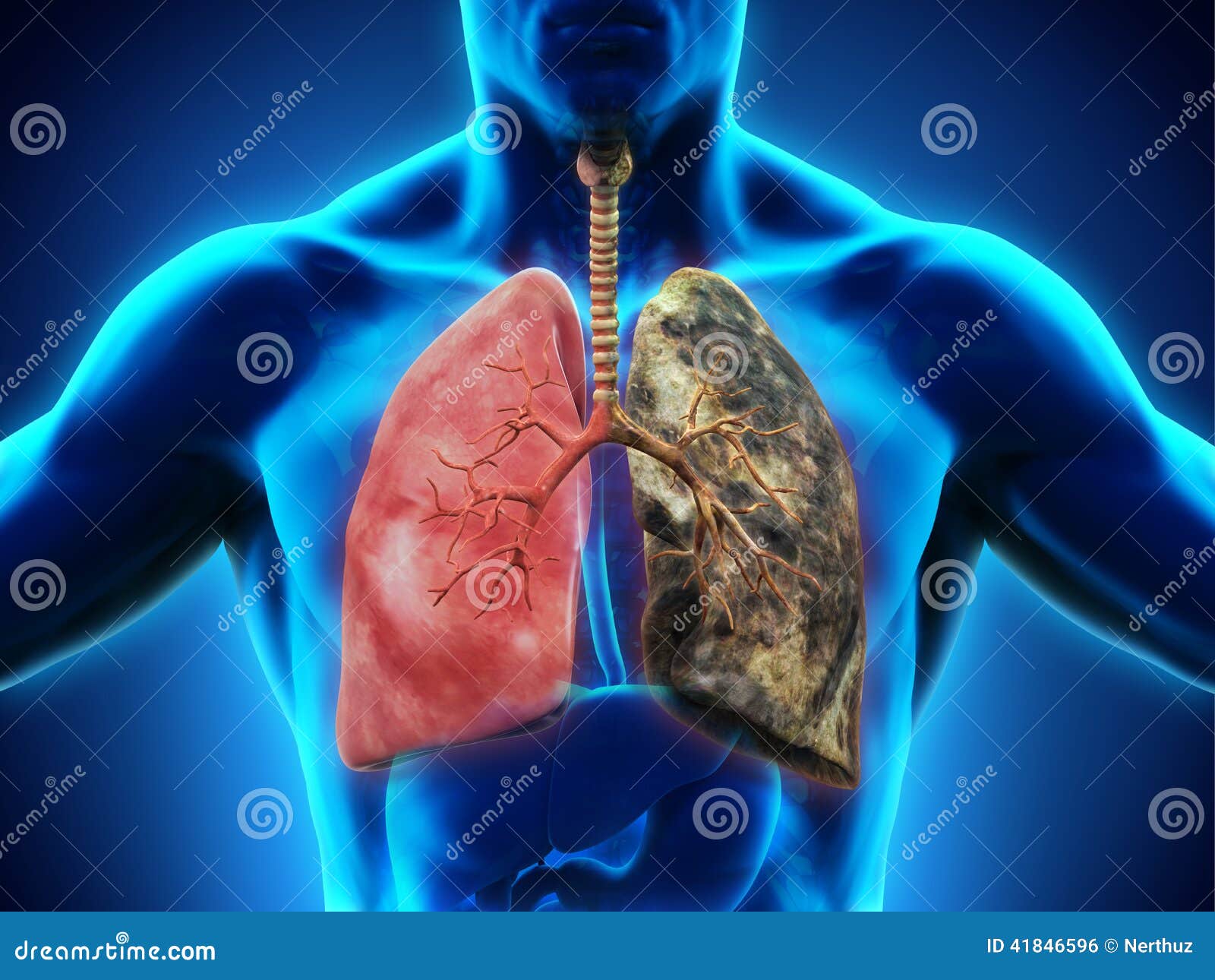 Gezonde Long en Rokerslong stock illustratie. Illustration of ...