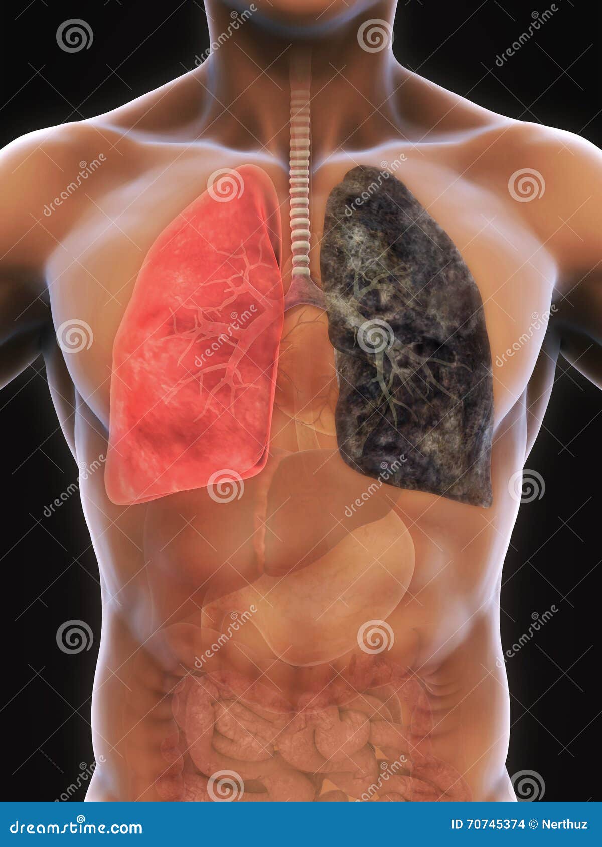 Gezonde Long en Rokerslong stock illustratie. Illustration of longen - 70745374