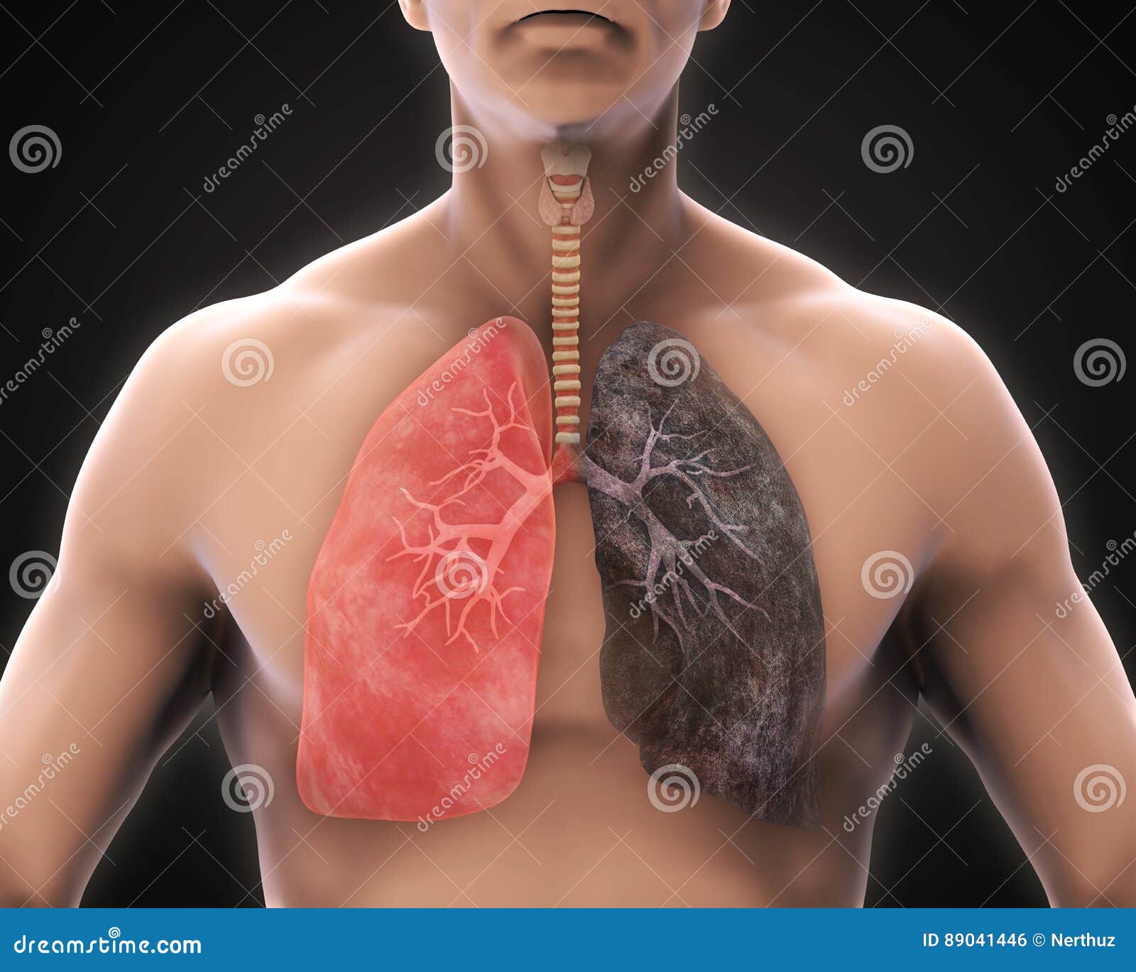 Gezonde Long en Rokerslong stock illustratie. Illustration of gezond - 89041446