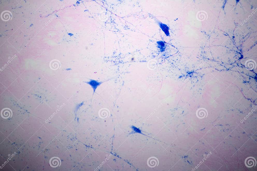 Giant multipolar neuron stock photo. Image of neuron - 119628422
