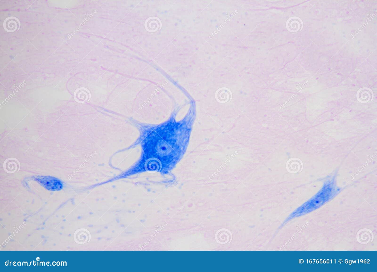 Giant multipolar neuron stock image. Image of neuron - 167656011