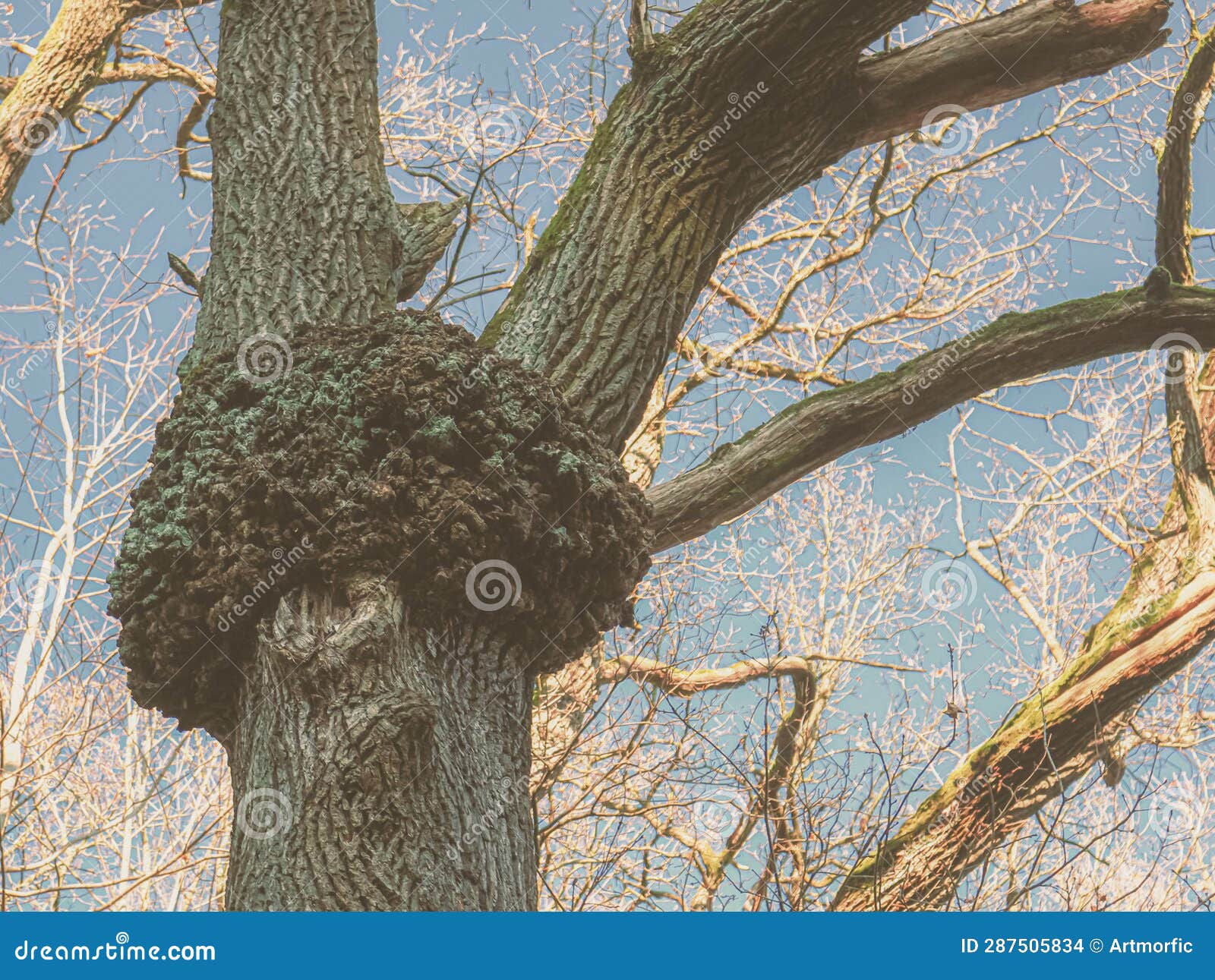 A Giant Tree Burl Caused by a Parasitoid Causing Bacteria Textured ...