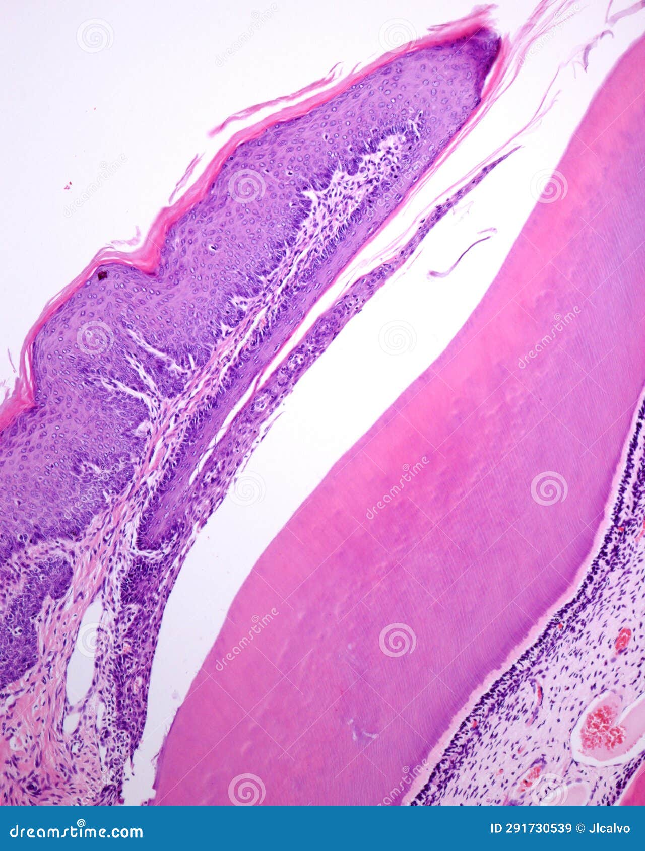 Gingiva. Junctional sulcus stock image. Image of odontoblast - 291730539