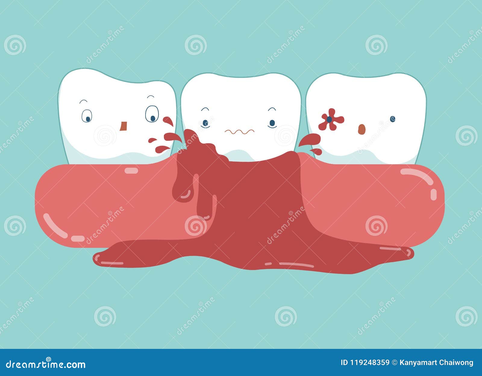 Gingivitis And Blood ,dental Concept Cartoon Vector | CartoonDealer.com ...