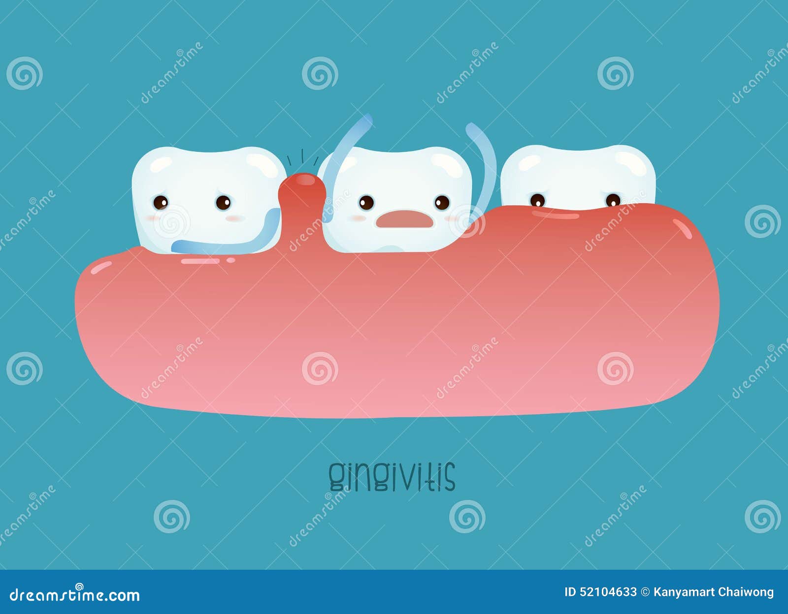 Gingivitis And Blood ,dental Concept Cartoon Vector | CartoonDealer.com ...